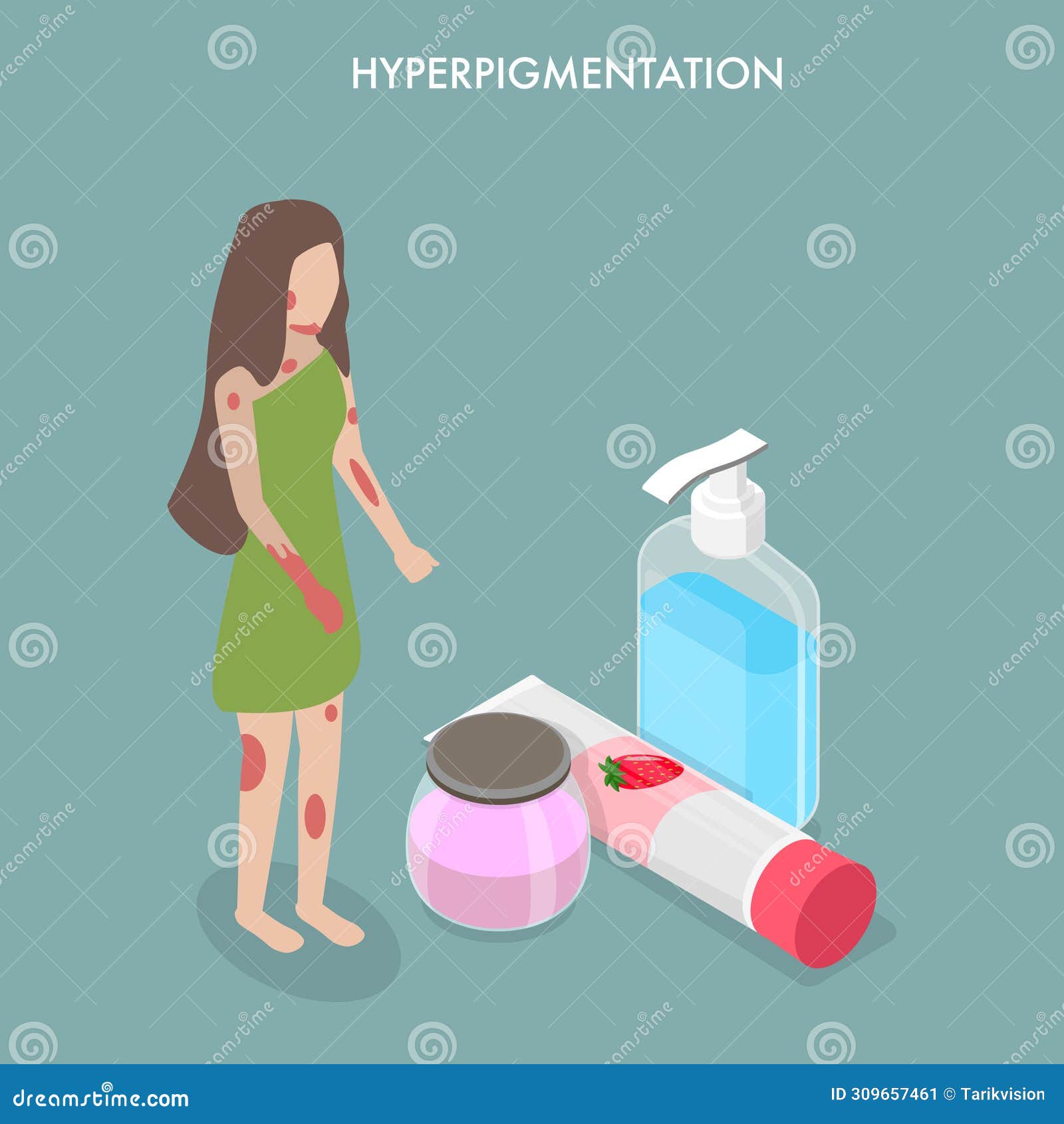 3D Isometric Flat Vector Illustration of Hyperpigmentation Stock ...