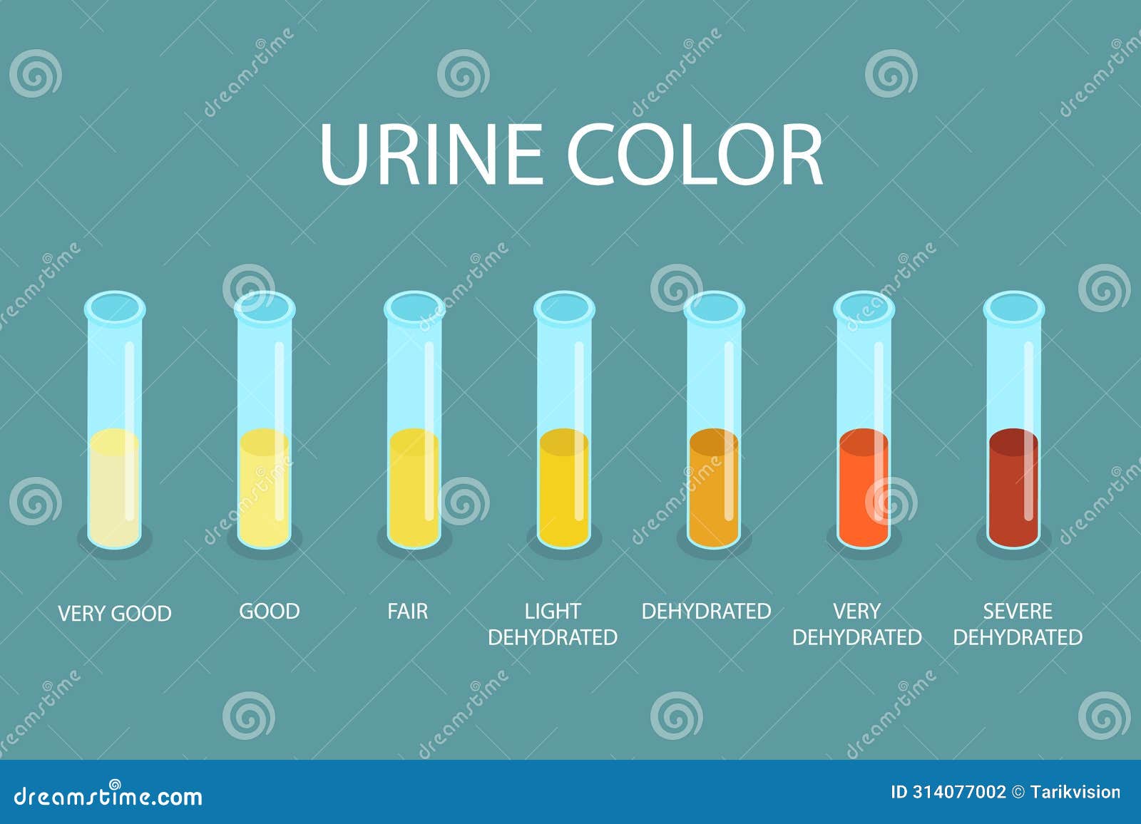 3D Isometric Flat Vector Illustration of Urine Color Chart Stock Vector ...