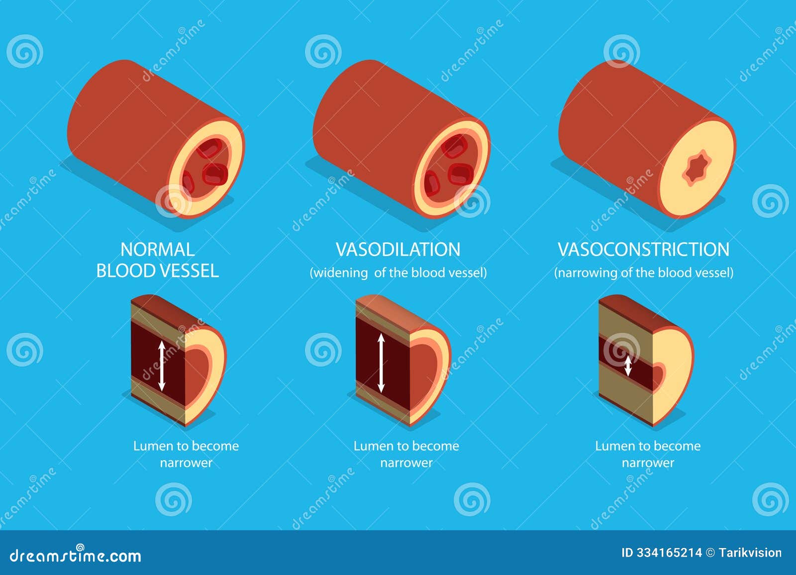 3D Isometric Flat Vector Illustration of Vasoconstriction and ...
