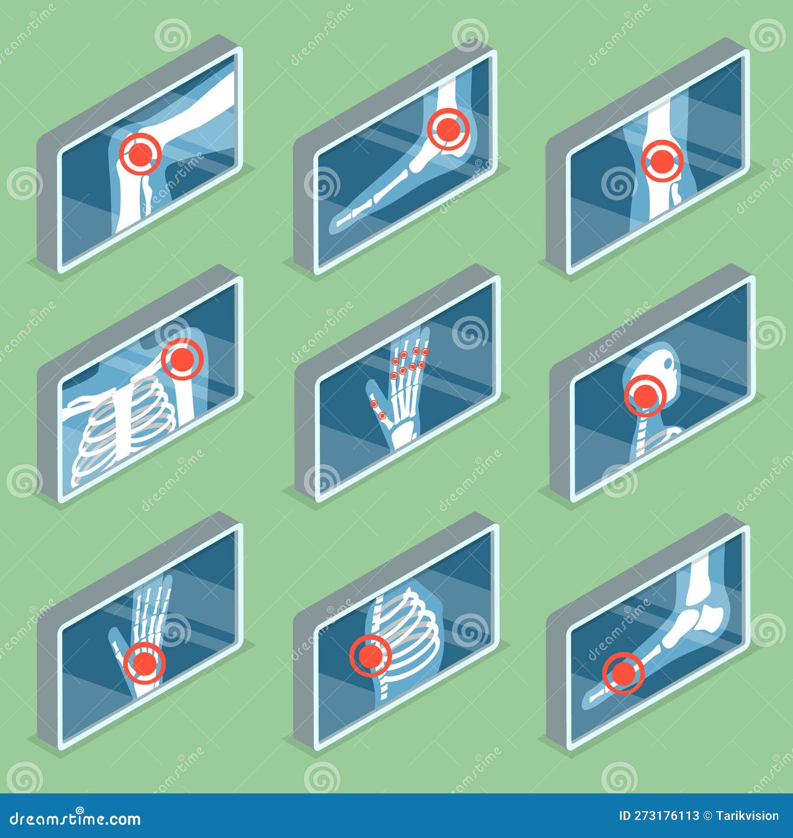 3D Isometric Flat Vector Set of Images of Human Joints Stock Vector ...