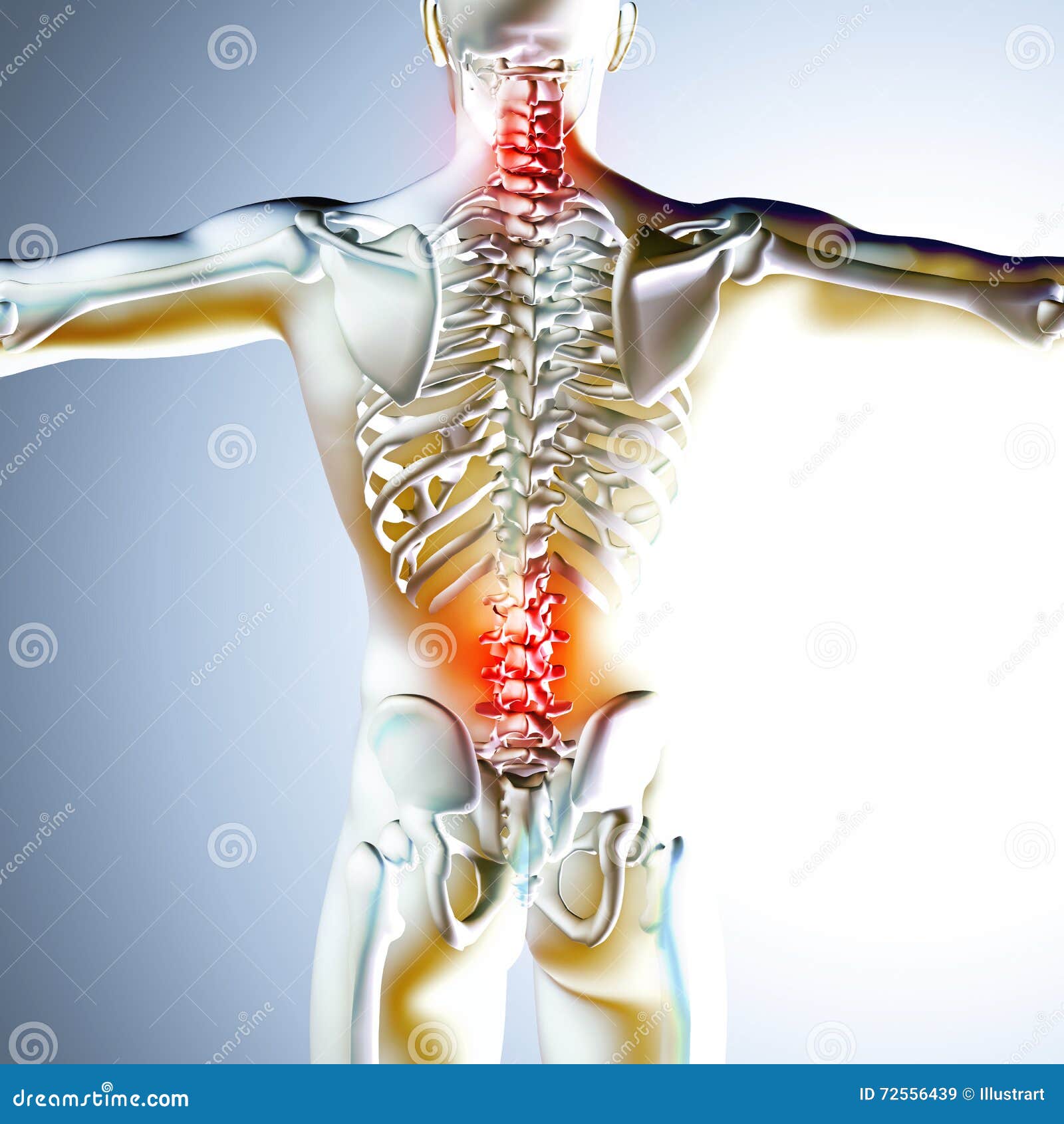 3d Medical Illustration Showing Back Pain Stock Illustration ...