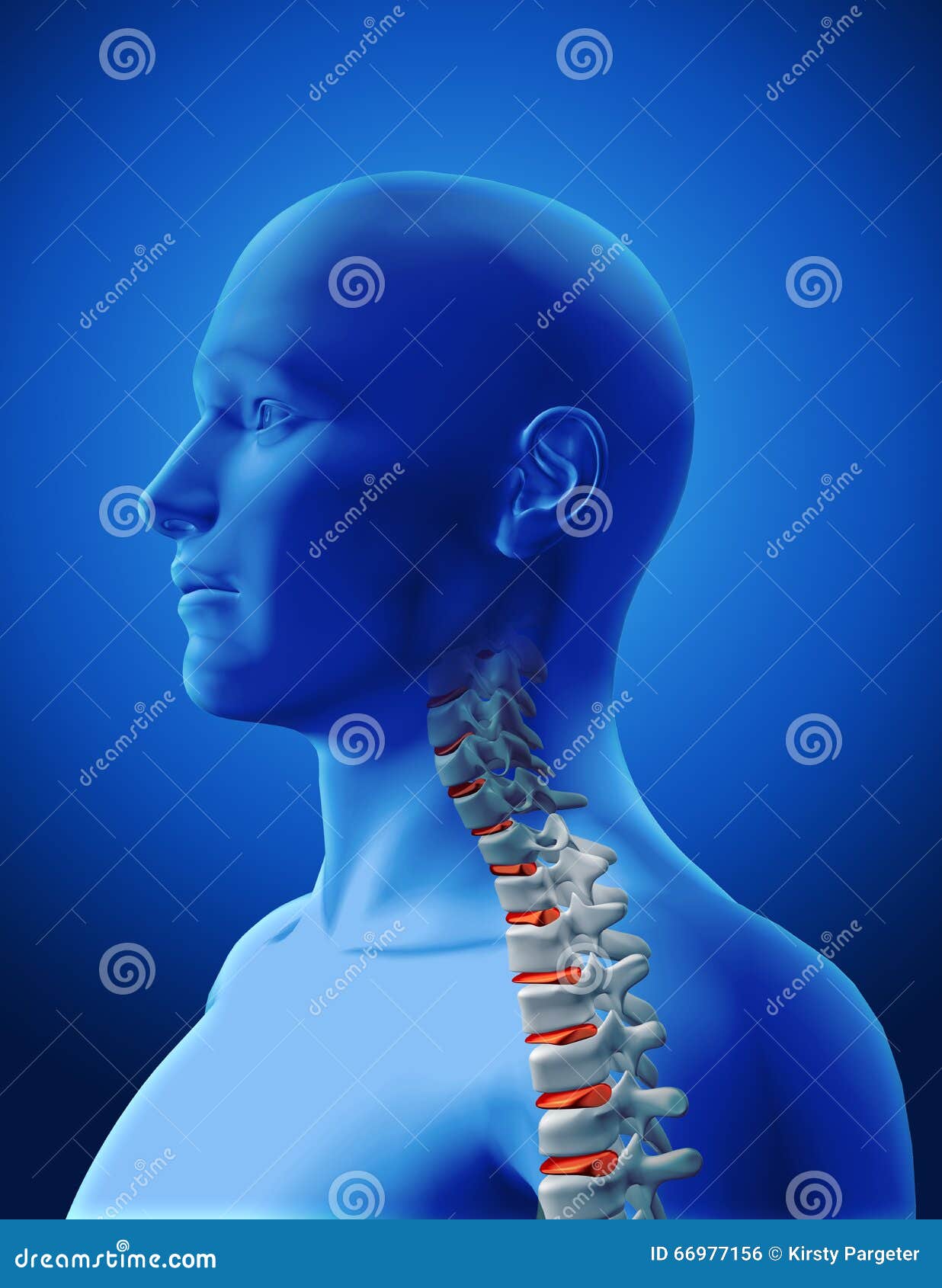 3D Medical Image Showing Spine With Highlighted Discs Stock Photography ...