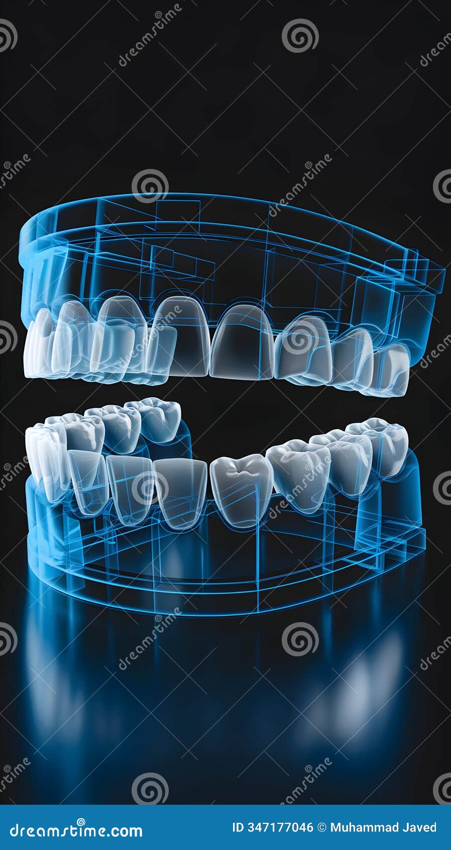 3D Model of Teeth and Gums in Translucent Blue with a Wireframe Overlay ...