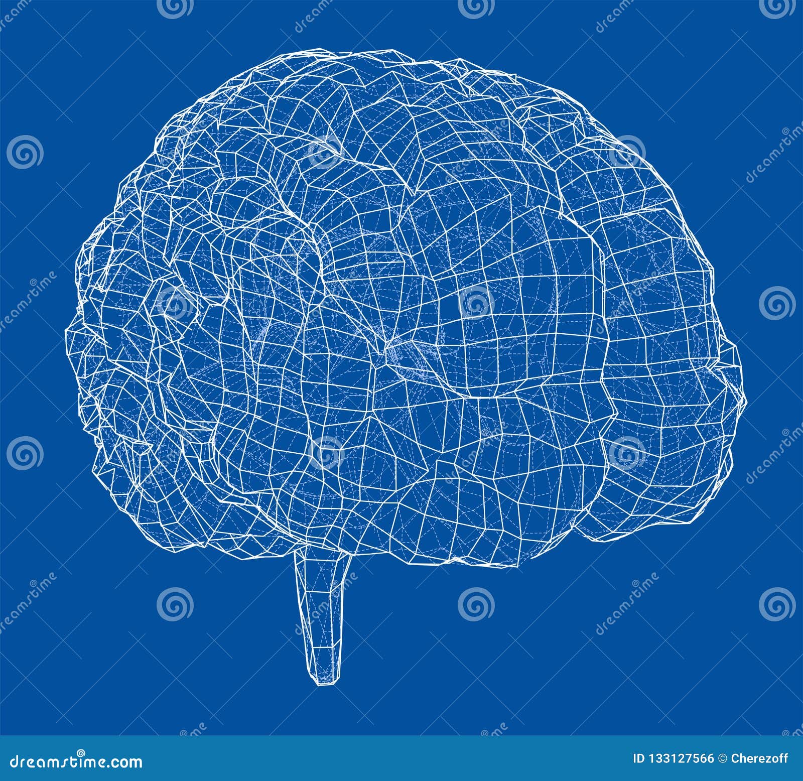 Brain With Wire Short Circuit In Cartoon Style Vector Illustration ...