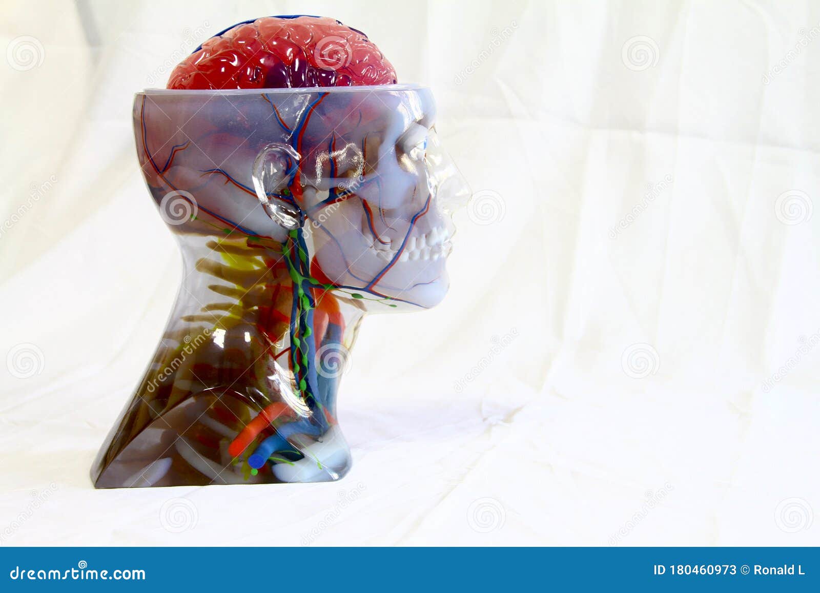 3D Printed Head with Neuro System. 3D Printing Technology Stock Image ...