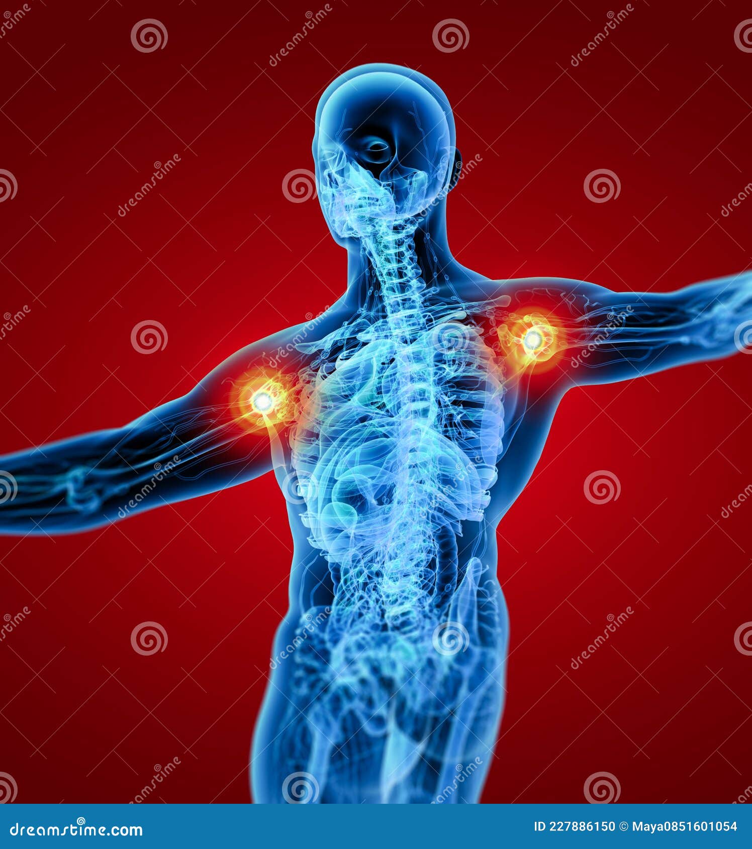 3D Rendering Illustration of Lymphatic System Stock Illustration ...