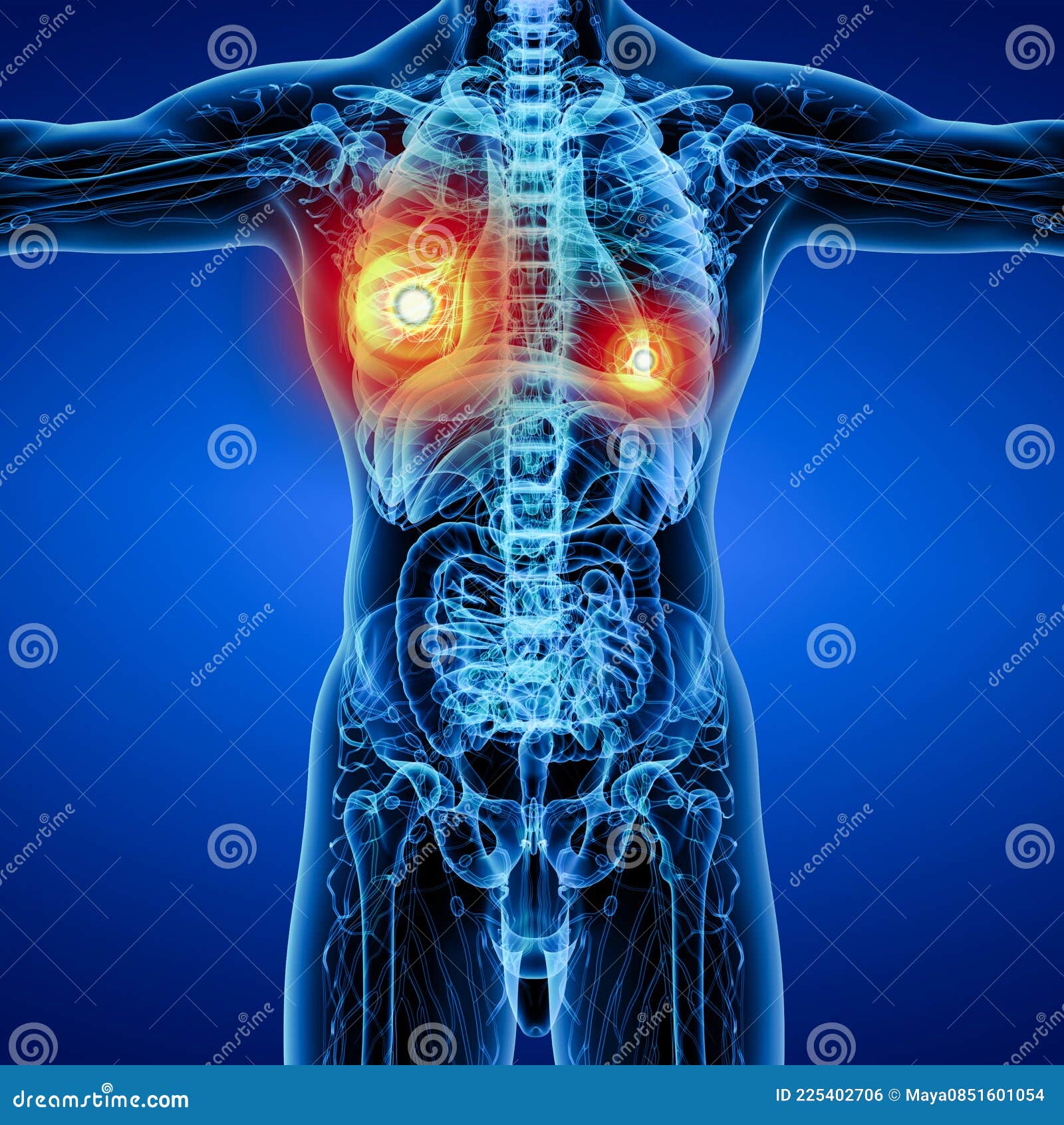 3D Rendering Illustration of Lymphatic System Stock Illustration ...