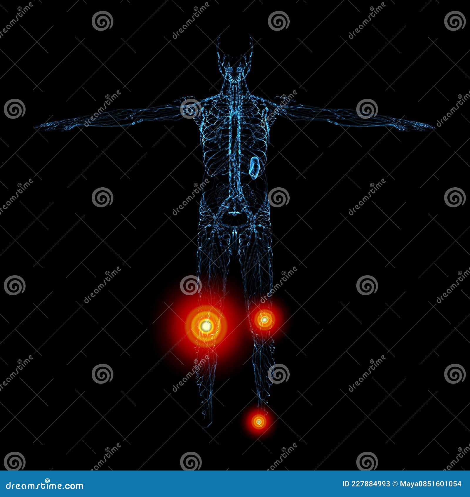 3D Rendering Illustration of Lymphatic System Stock Illustration ...