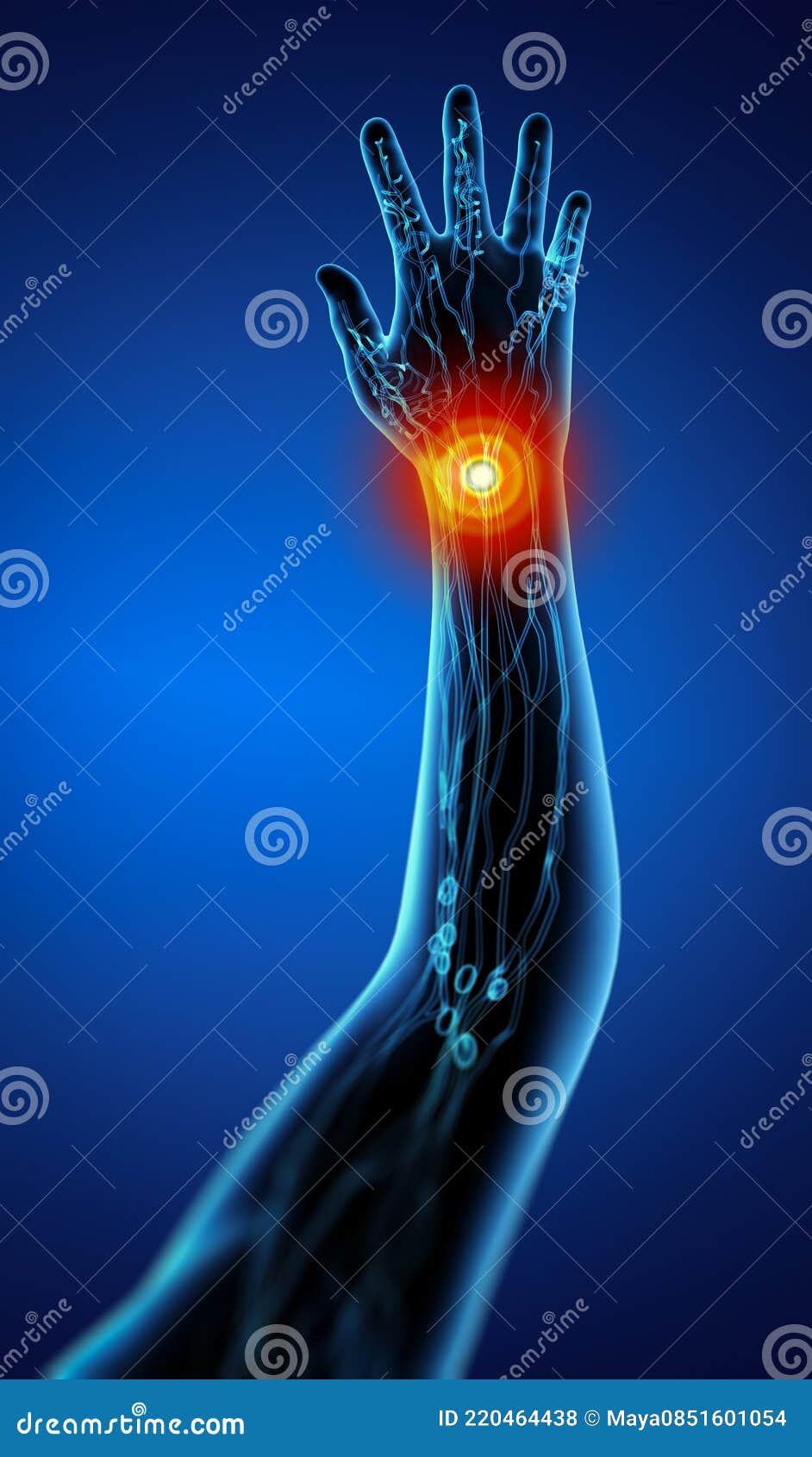 3D Rendering Illustration of Lymphatic System Stock Illustration ...