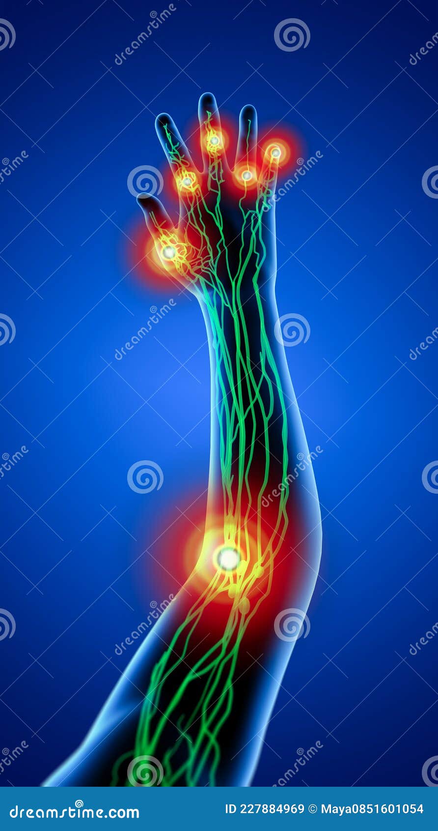 3D Rendering Illustration of Lymphatic System Stock Illustration ...