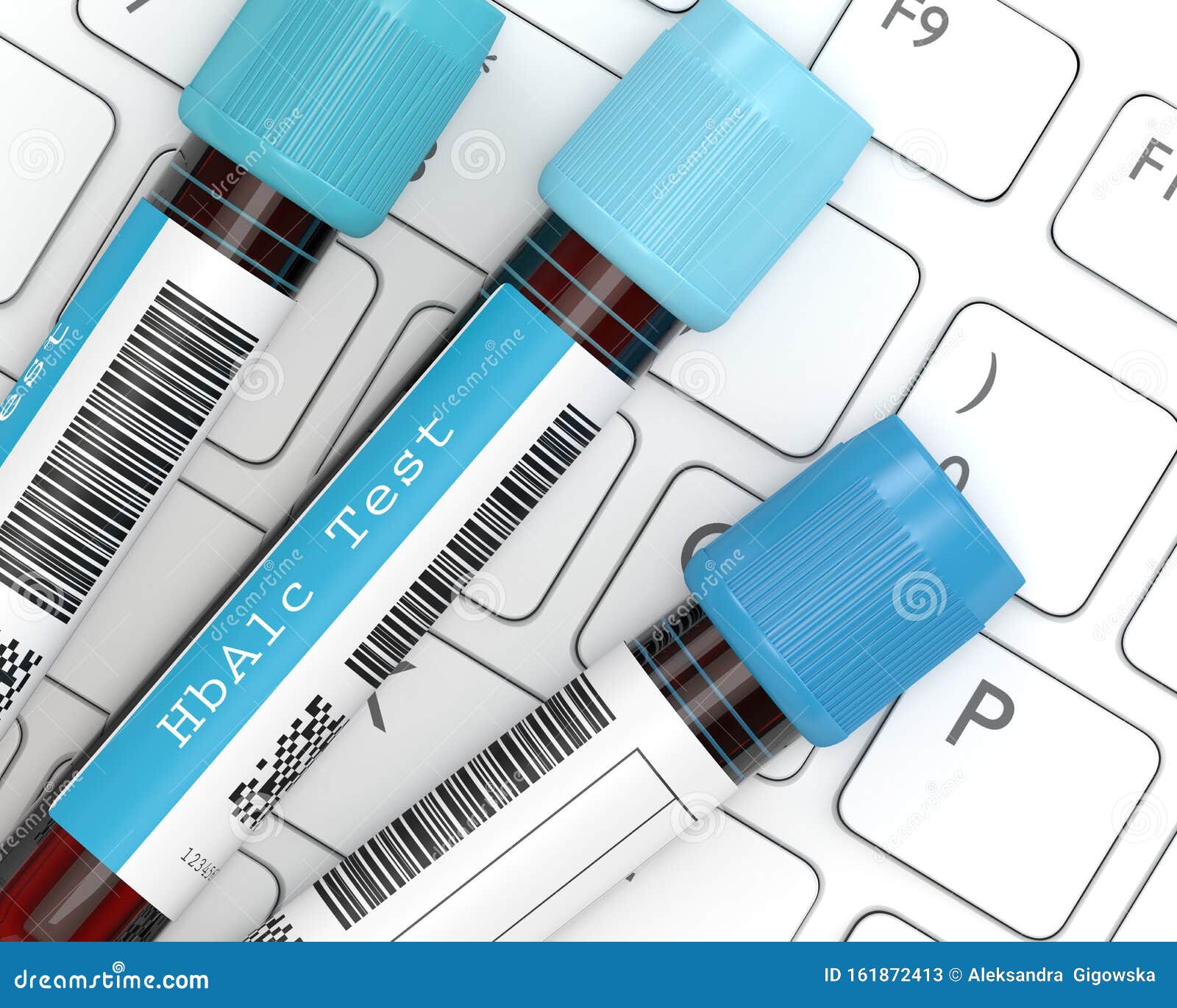 HbA1c Glycated Hemoglobin Mind Map, Medical Concept For Presentations ...