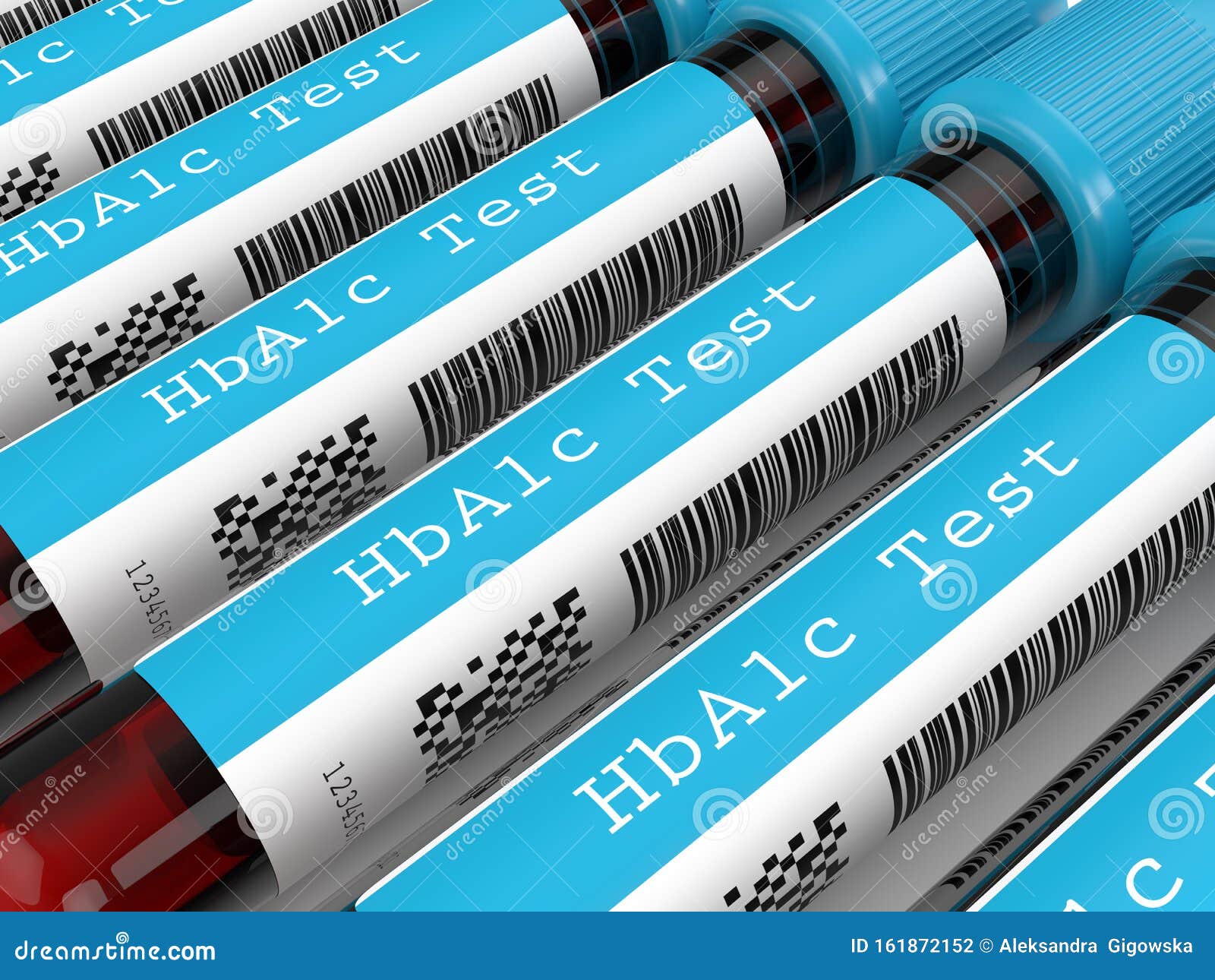 Hemoglobin A1C (HbA1c) Blood , Glycated Hemoglobin, HbA1c Test ...