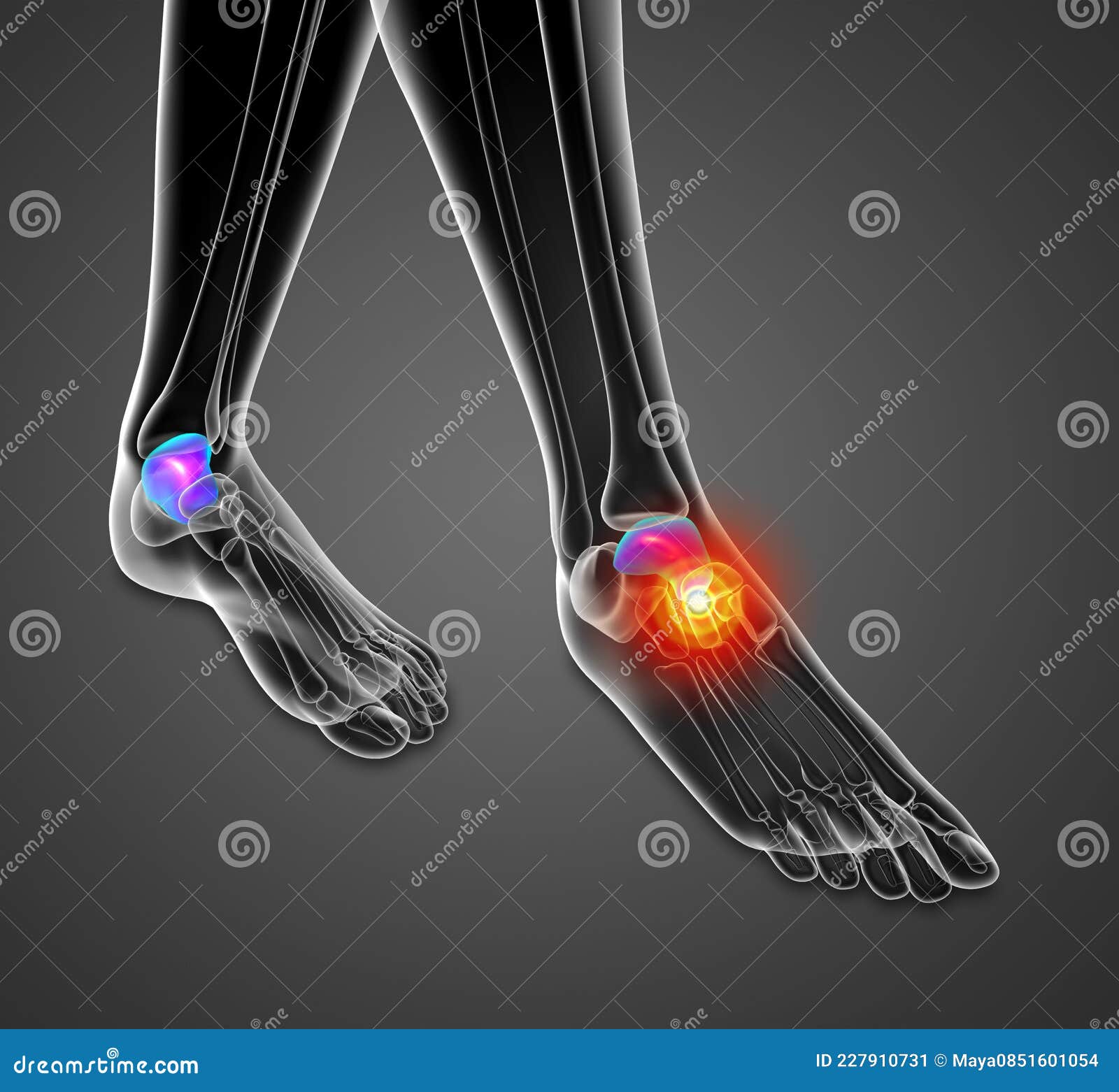 3d Render Illustration of the Malleolus Bone Stock Illustration ...