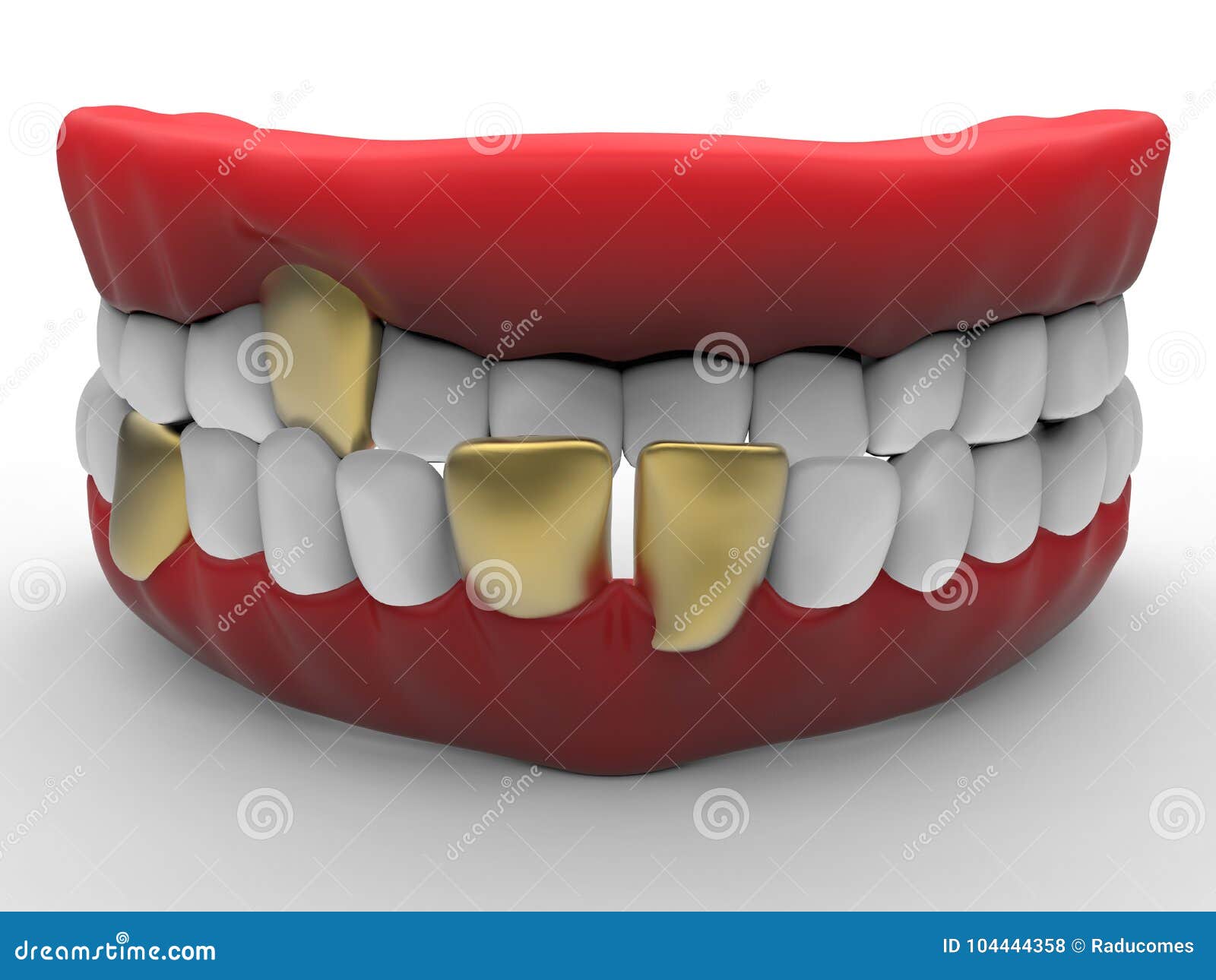 Golden teeth concept stock illustration. Illustration of render - 104444358