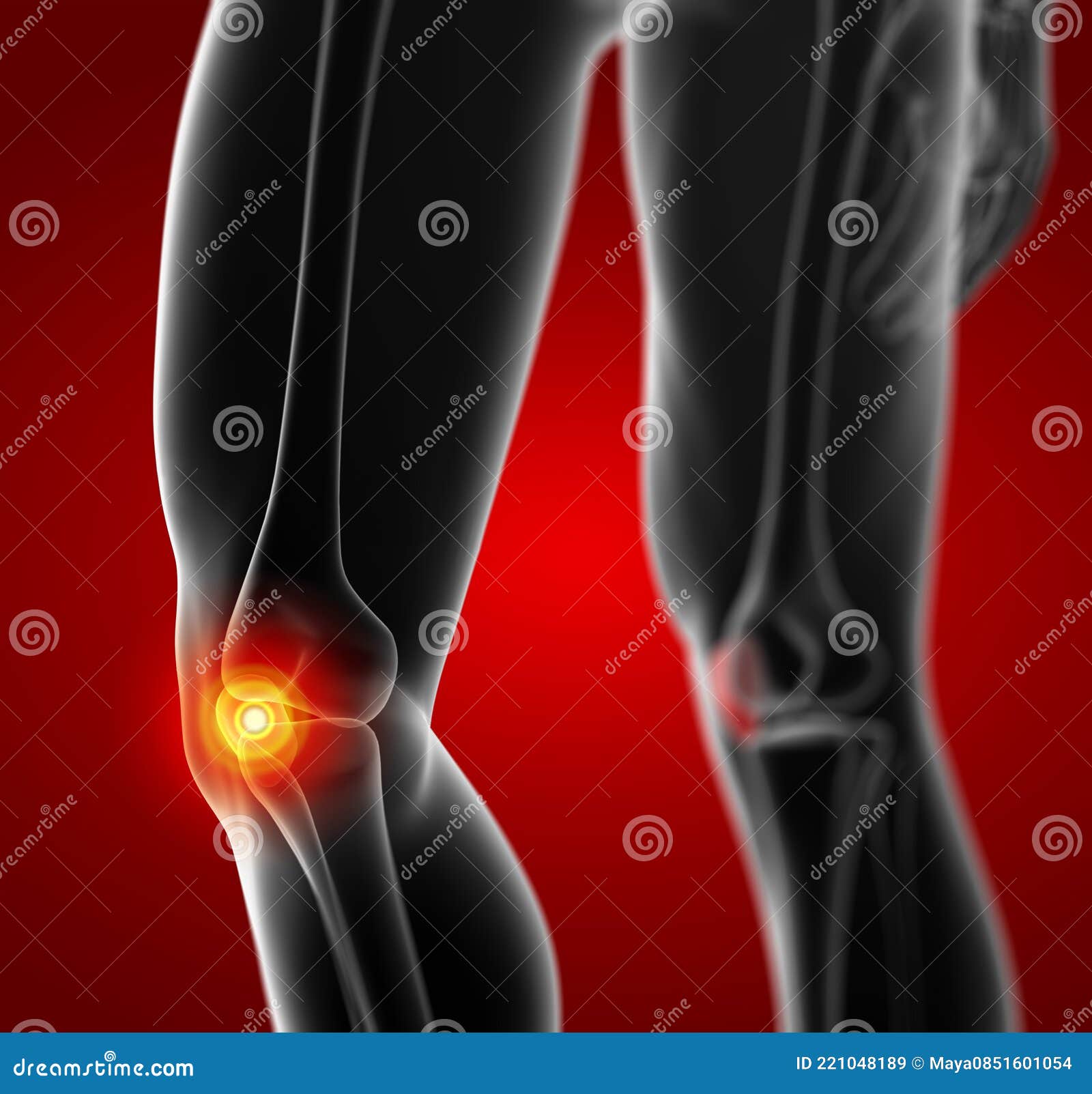 3D Rendering Illustration of Patella Stock Illustration - Illustration ...
