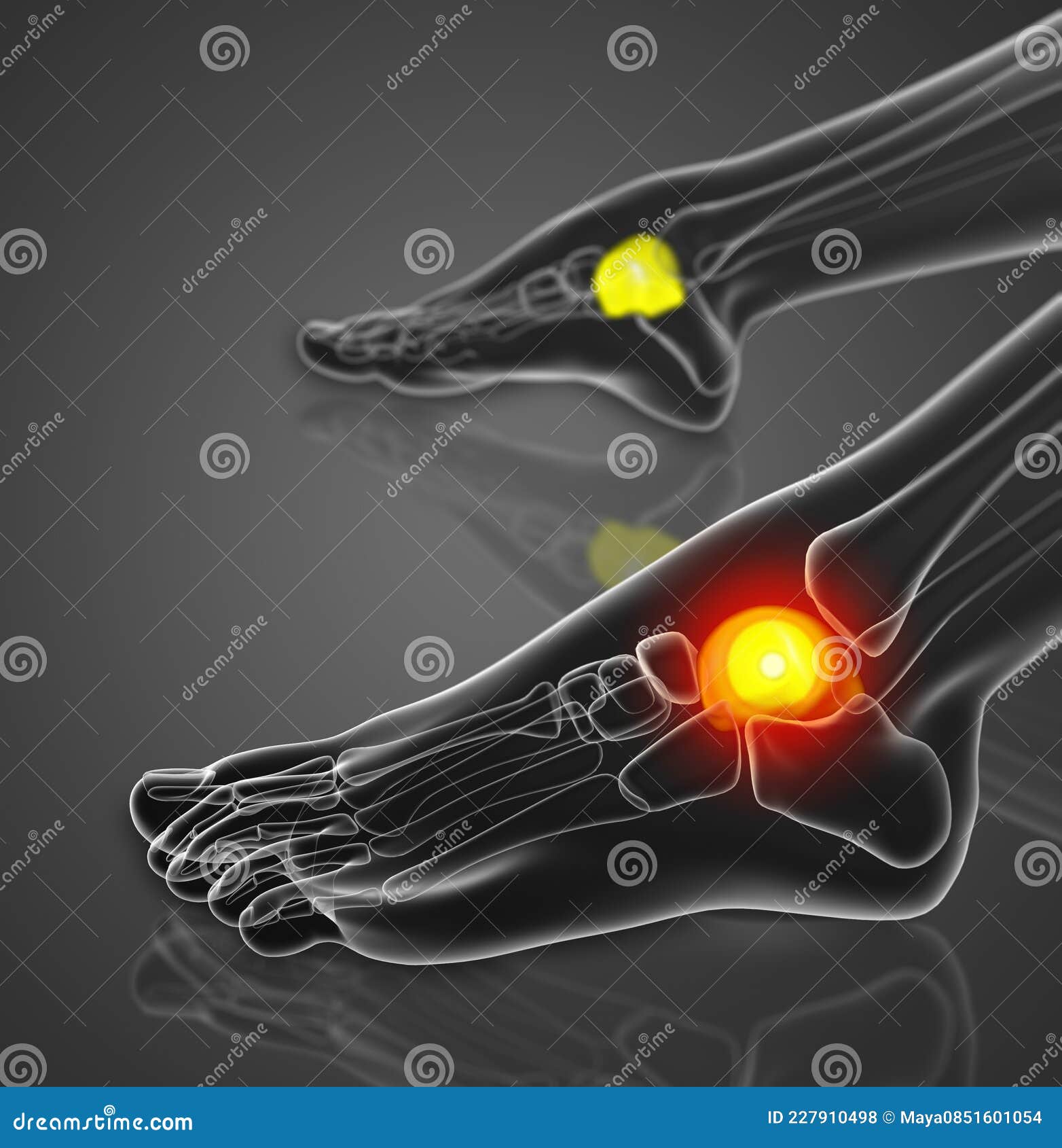 3d Render Illustration of the Talus Bone Stock Illustration ...