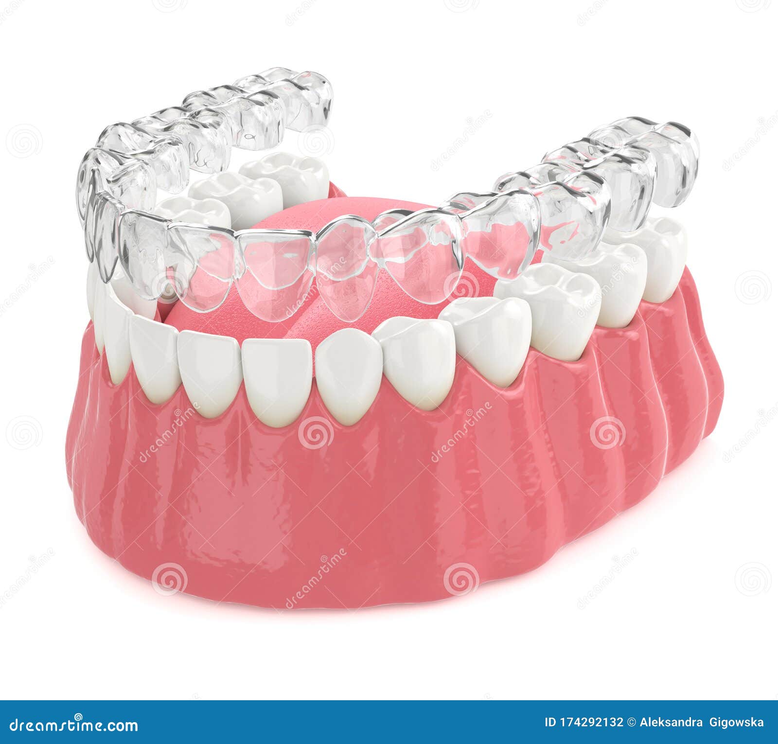 3d Render of Invisalign Removable Retainer with Lower Jaw Stock ...