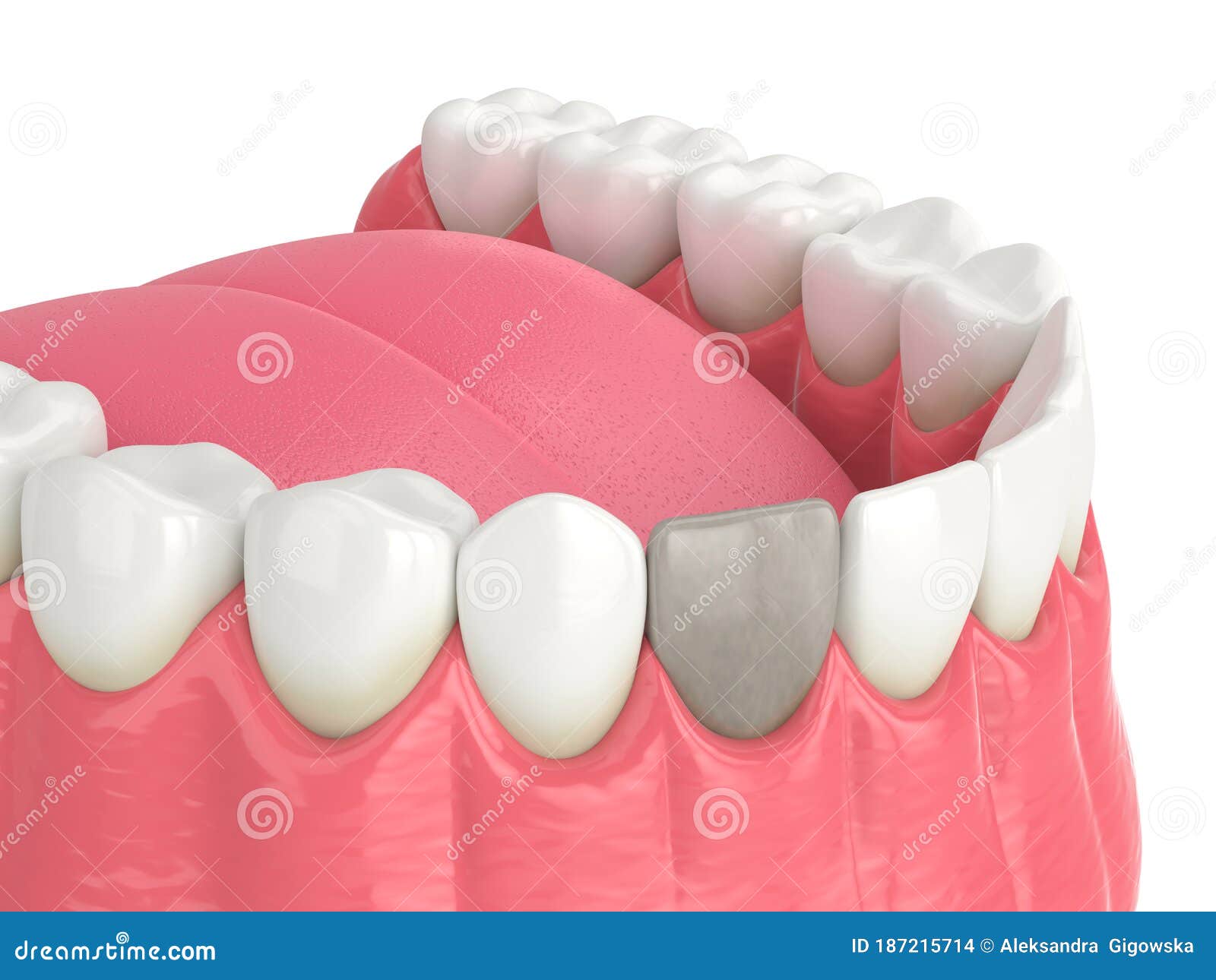 Tooth Pulp Icon, Cartoon Style | CartoonDealer.com #178870421