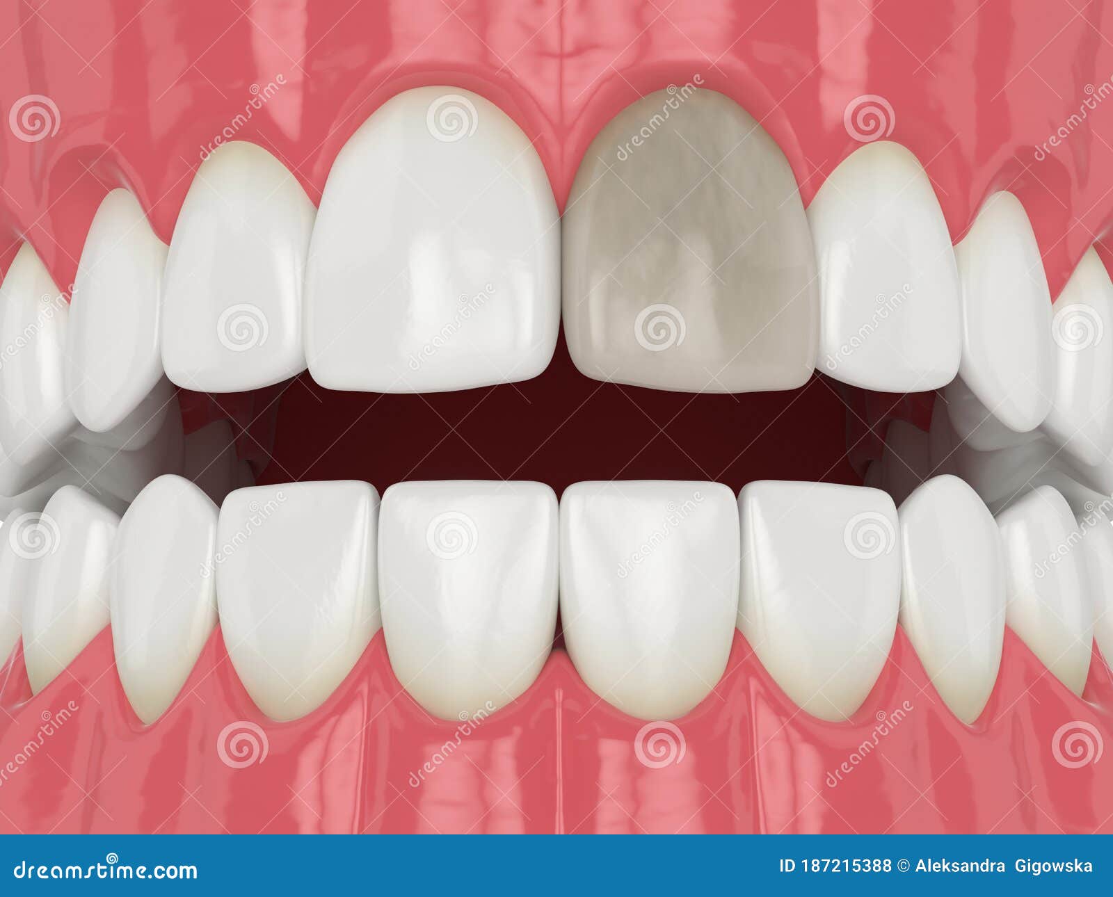 Tooth Pulp Icon, Cartoon Style | CartoonDealer.com #178870421