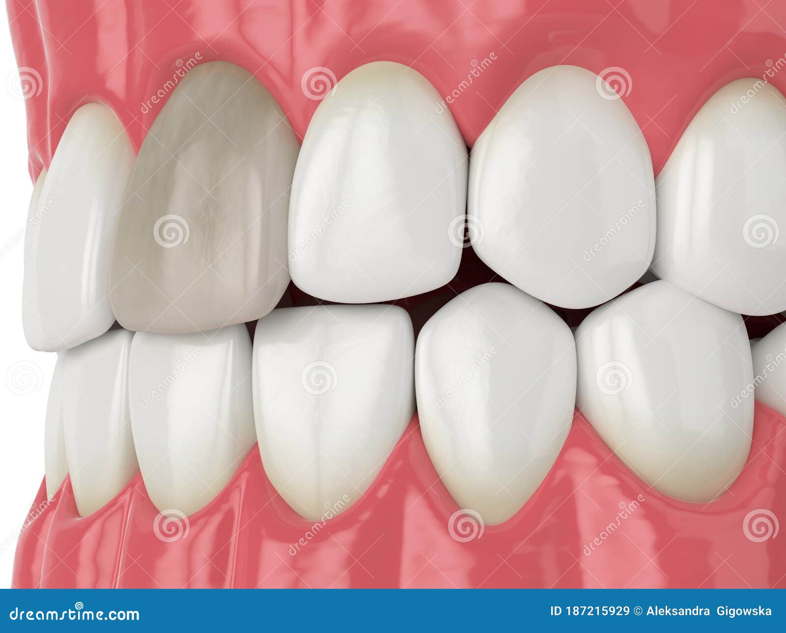 Tooth Pulp Icon, Cartoon Style | CartoonDealer.com #178870421