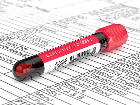 3d Render with Lipid Profile Test Blood Sample Stock Illustration ...