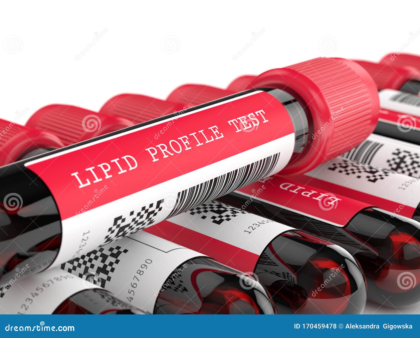 3d Render With Lipid Profile Test Blood Sample Stock Photo ...