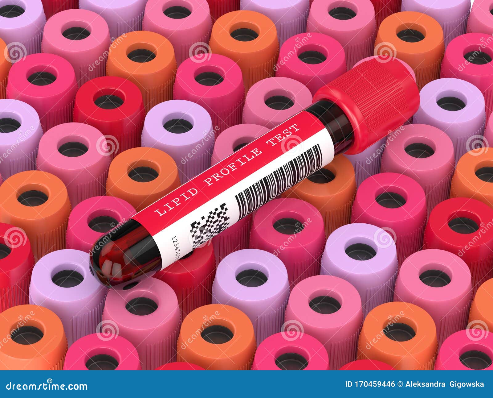 3d Render with Lipid Profile Test Blood Samples Stock Illustration ...