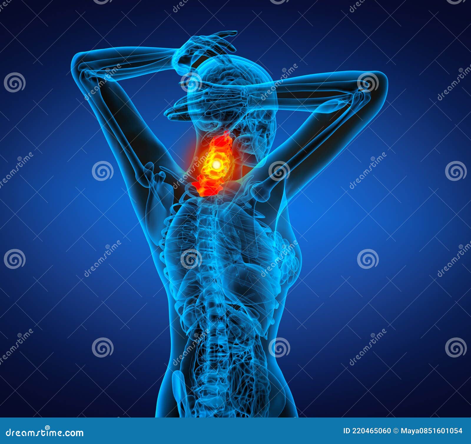 3d Render Medical Illustration of the Cervical Spine Stock Illustration ...