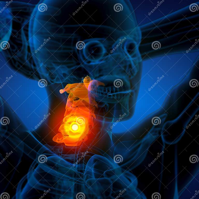 3d Render Medical Illustration Of The Cervical Spine Stock Illustration Illustration Of Human