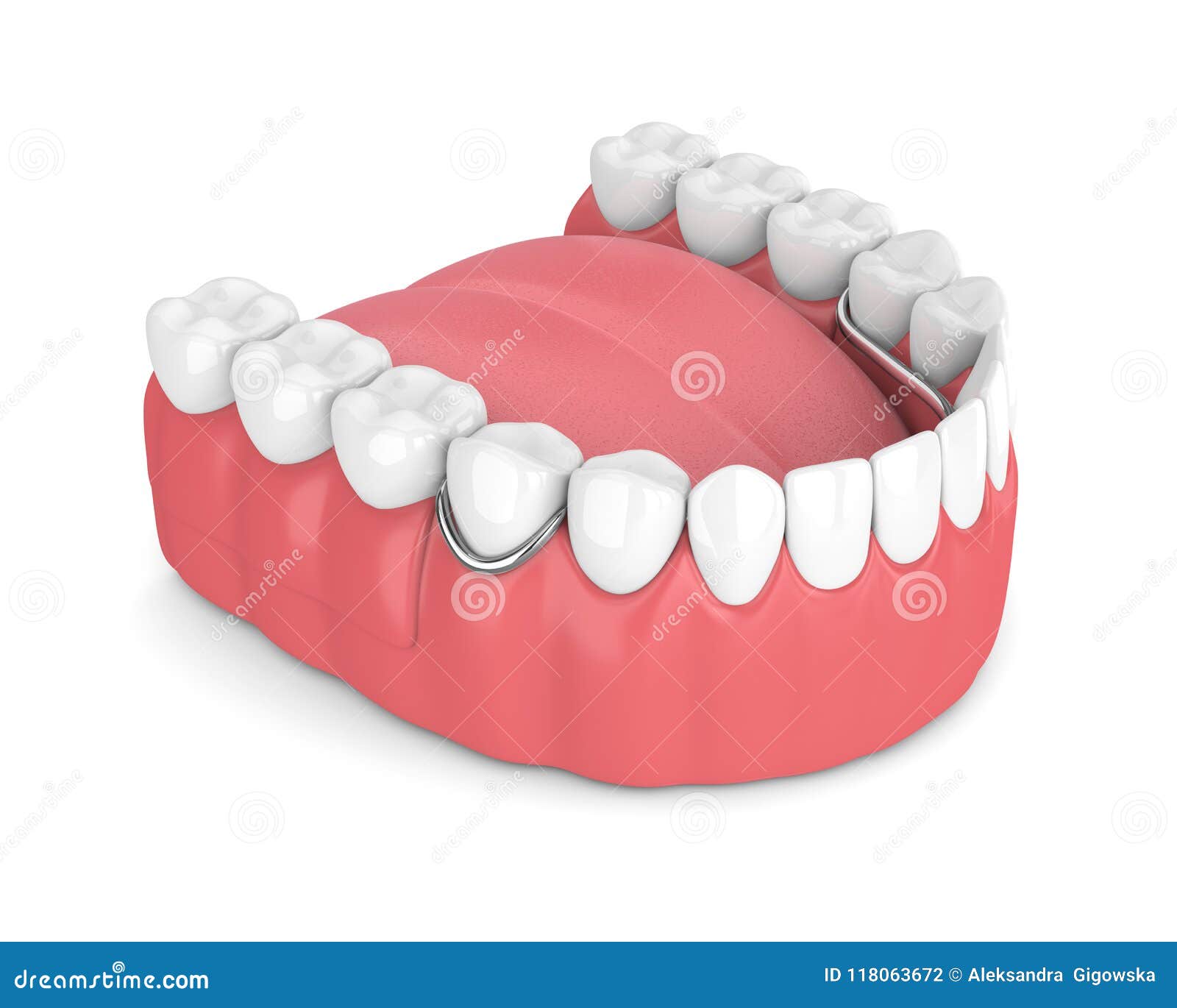 Partial Denture Transparent Icon. Partial Denture Symbol Design Cartoon ...