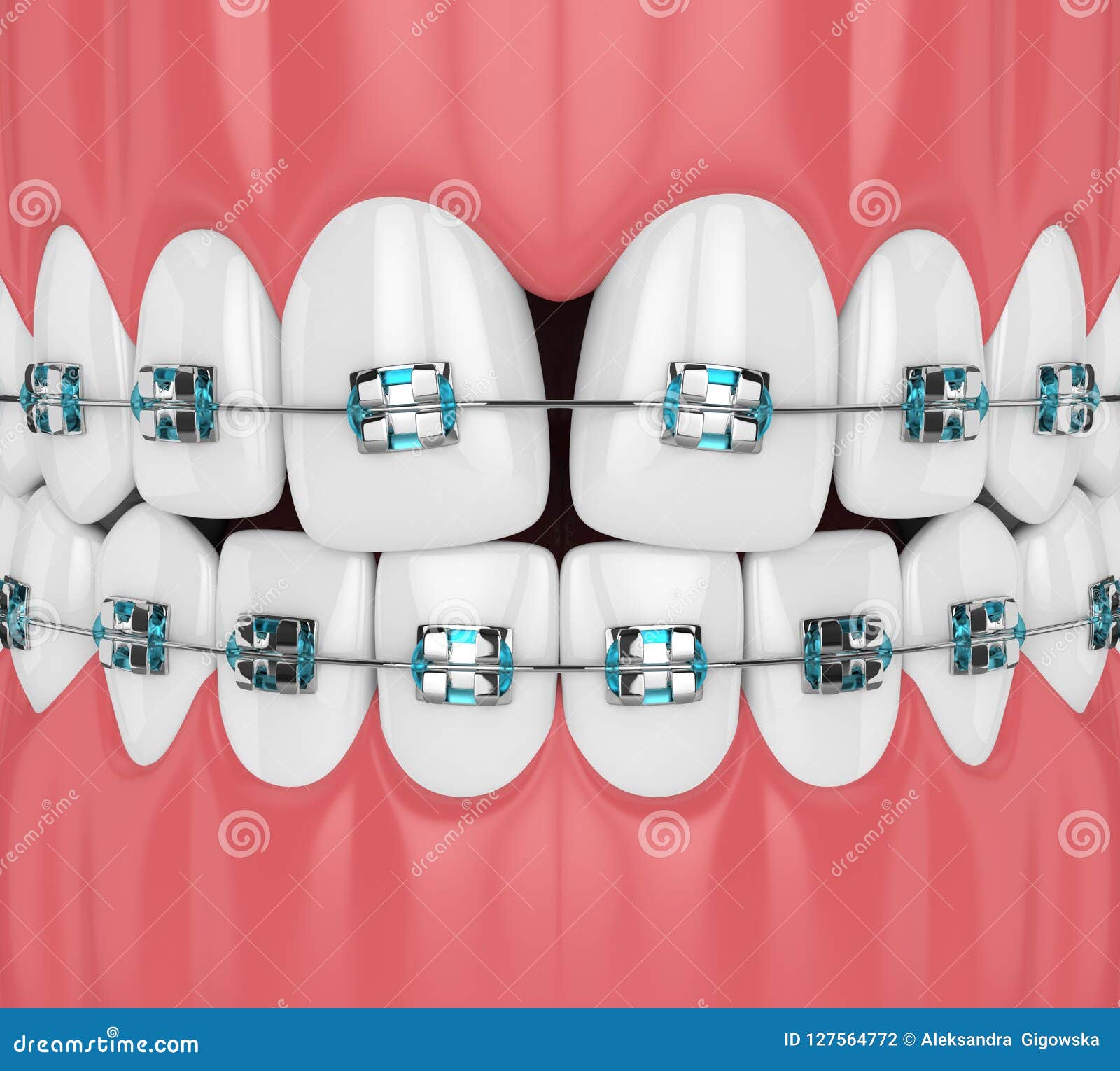 Divergent Vs Convergent Evolution With Ancestors Development Outline ...