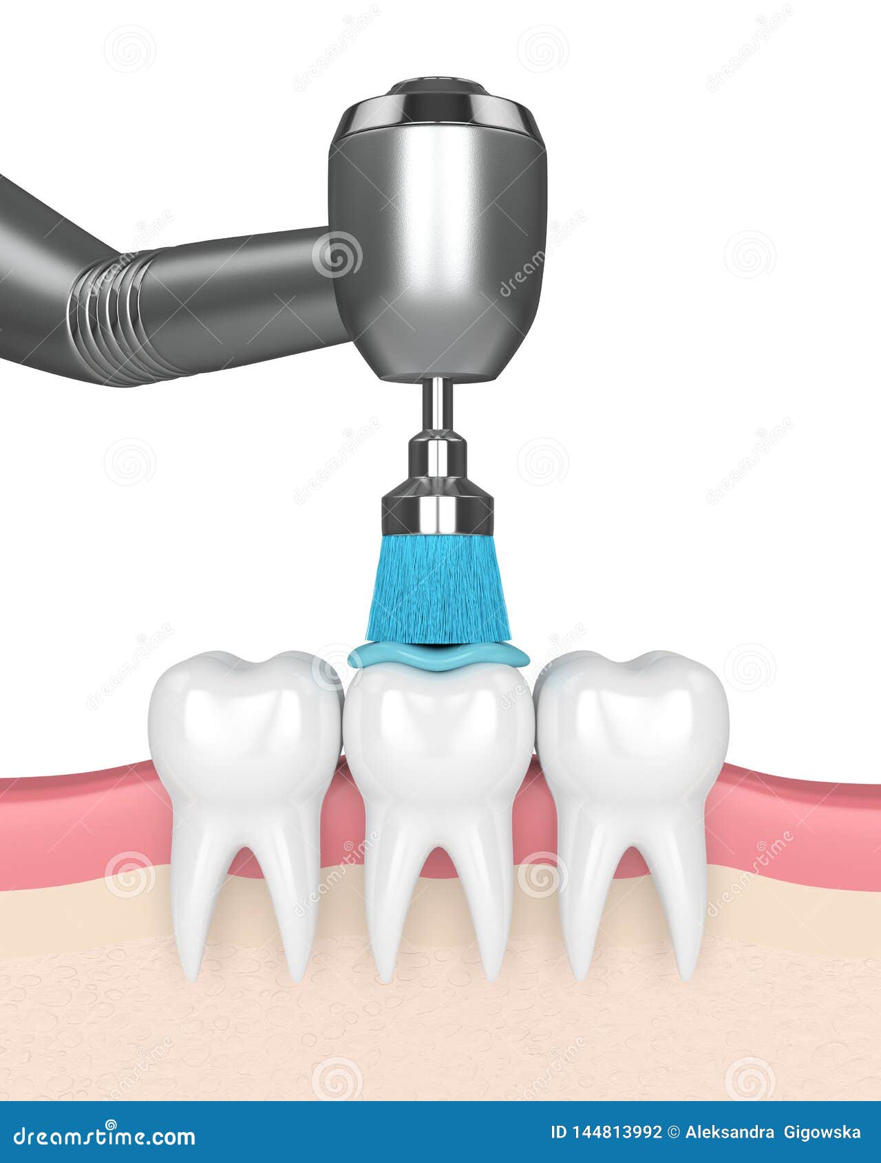 3d Render of Teeth with Dental Handpiece and Polishing Brush Stock ...