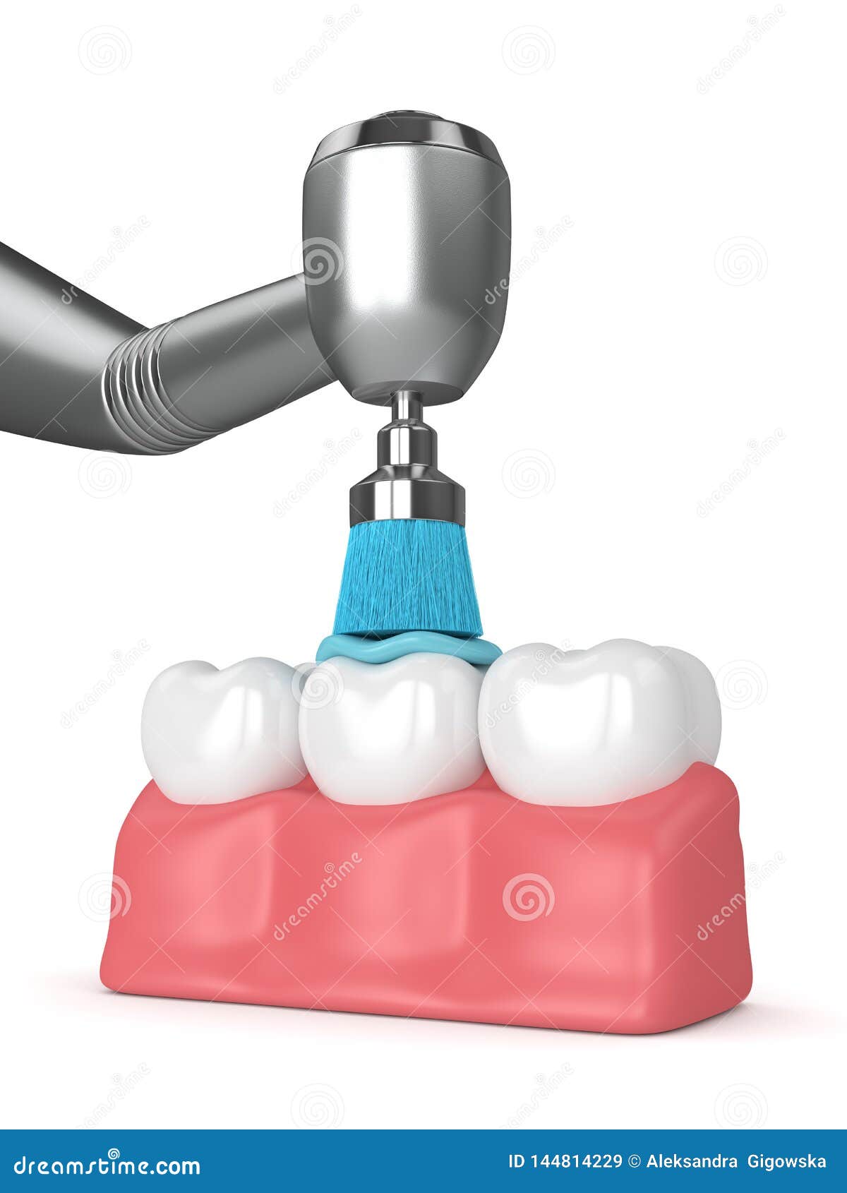 3d Render of Teeth with Dental Handpiece and Polishing Brush Stock ...