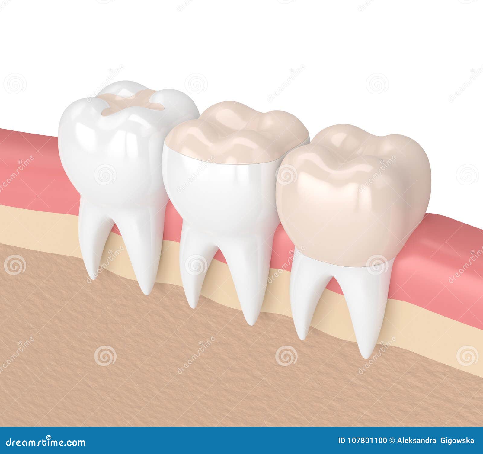 Inlay Onlay Overlay Together Friends Holding Hands Drawing Illustration ...