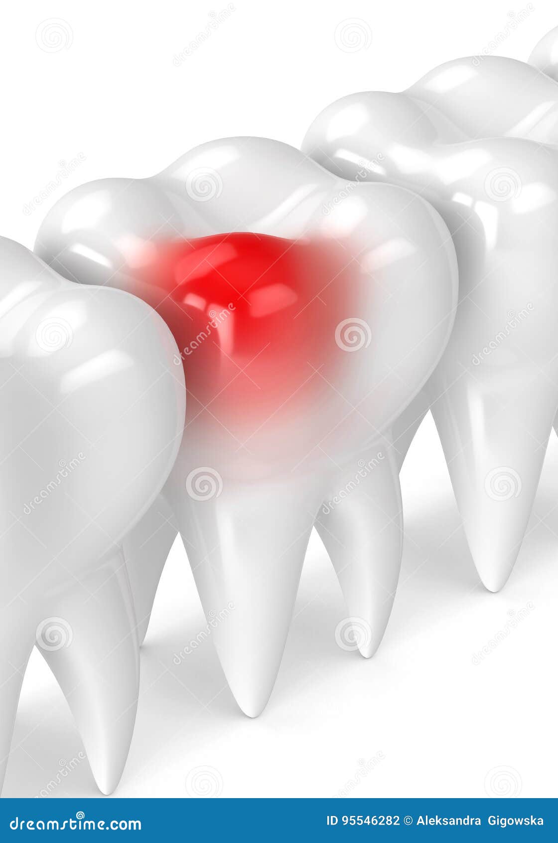 3d Render of Teeth with Toothache Over White Stock Illustration ...