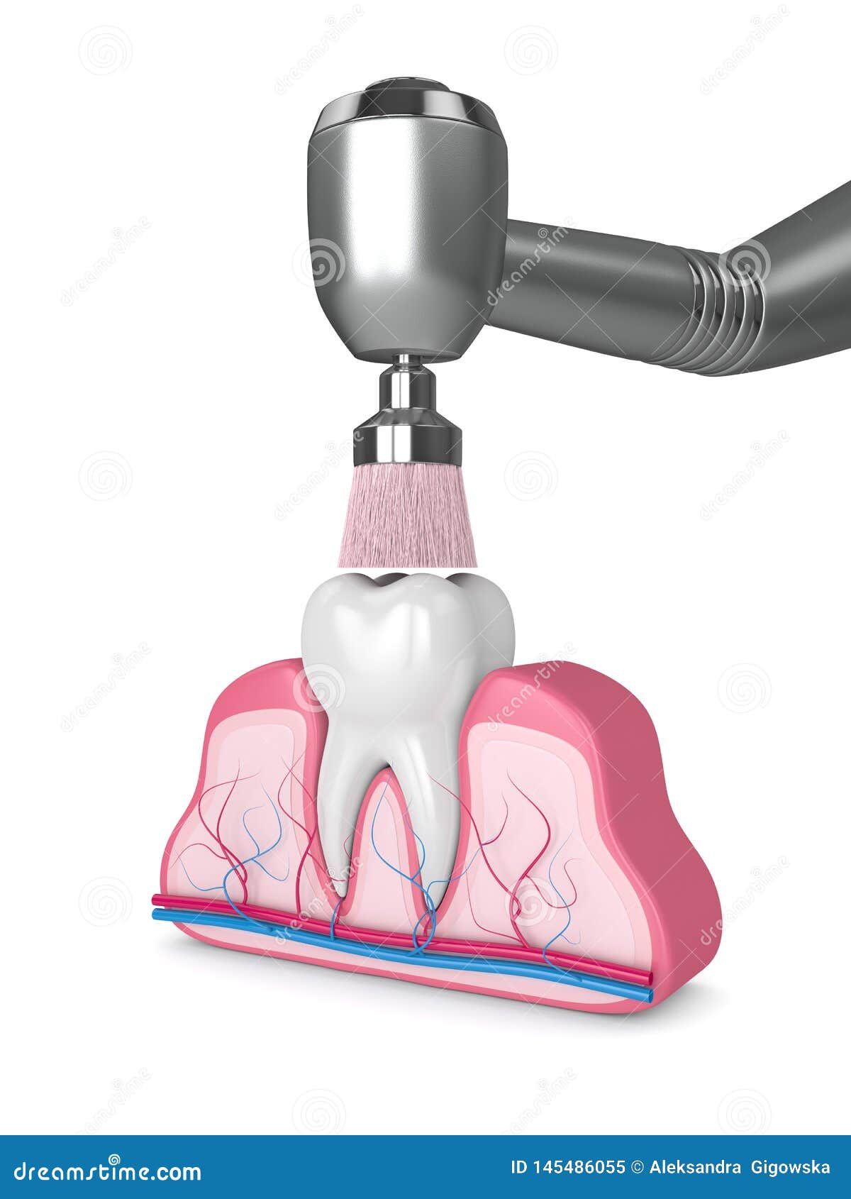 3d Render of Tooth with Dental Handpiece and Polishing Brush Stock ...