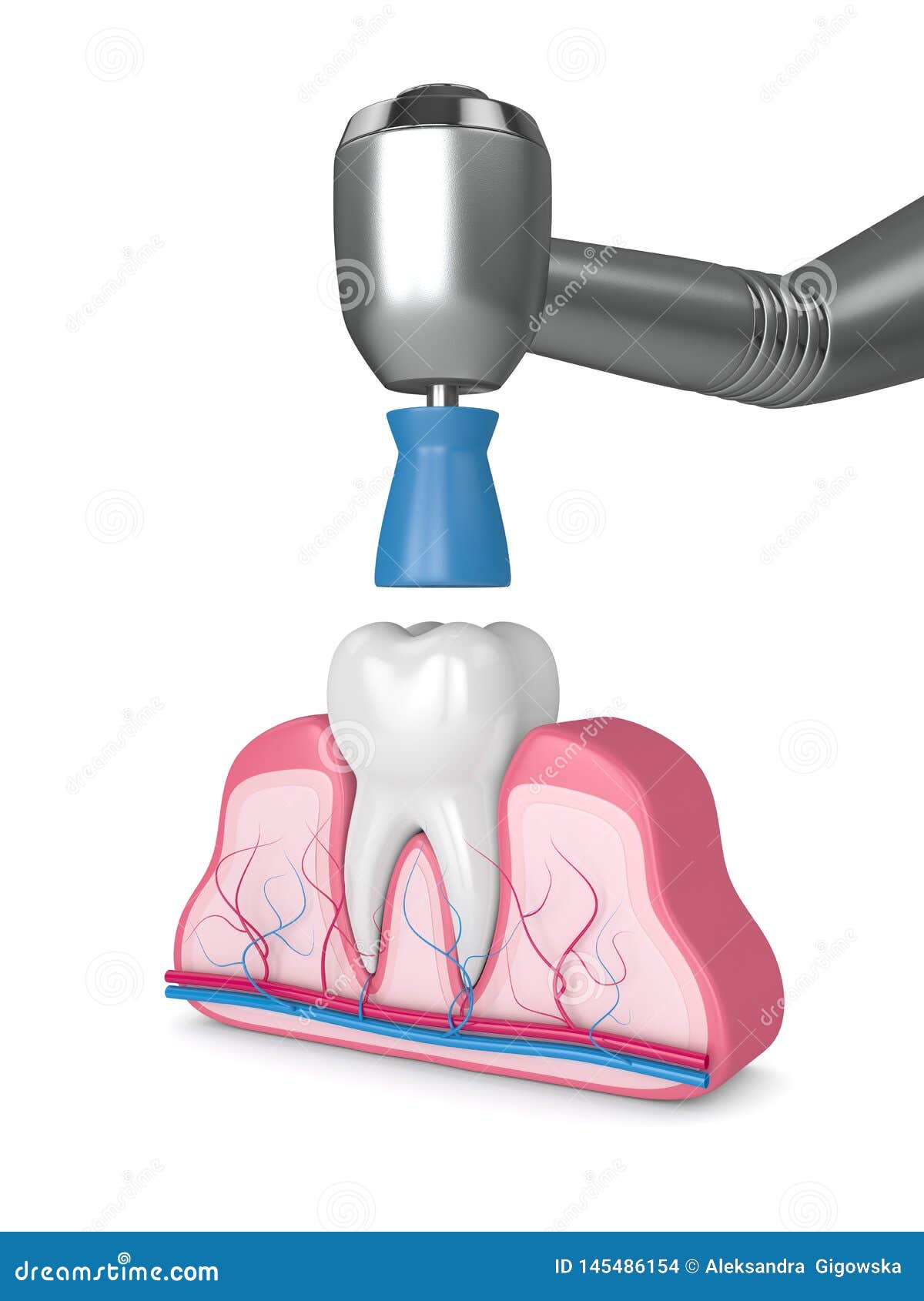 3d Render of Tooth with Dental Handpiece and Polishing Prophy Cup Stock ...