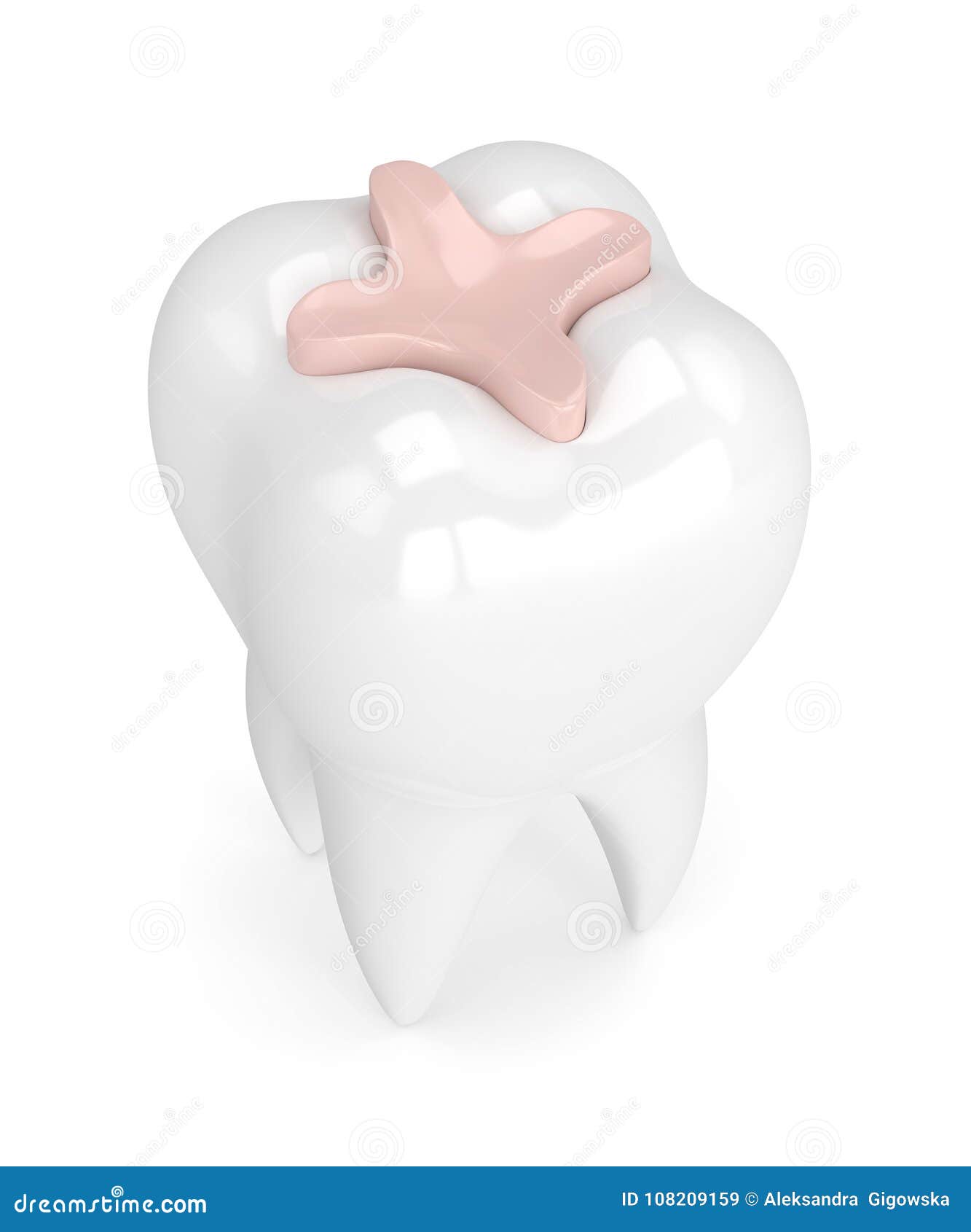 3d Render Of Tooth With Endodontic File In Jaw Royalty-Free Stock ...