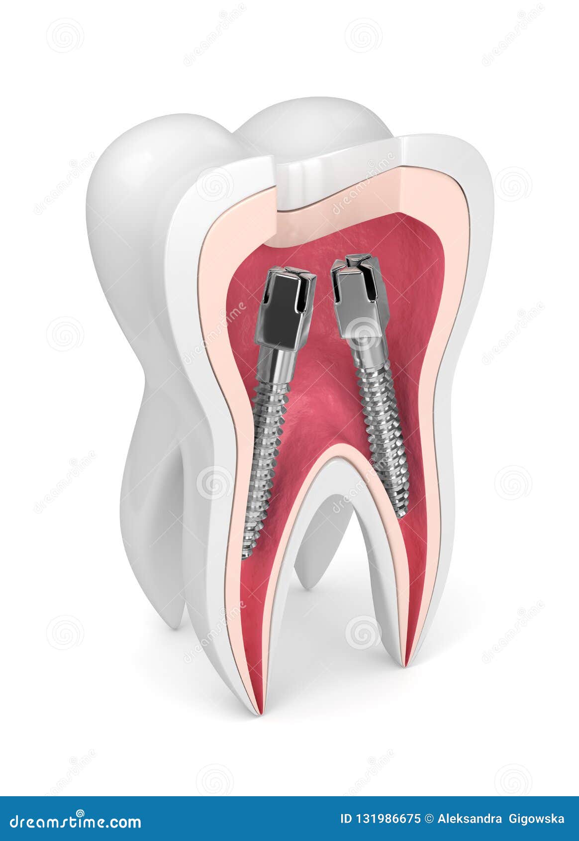 Dental Root Anatomy - First Maxillary Molar Tooth. Medically Accurate ...