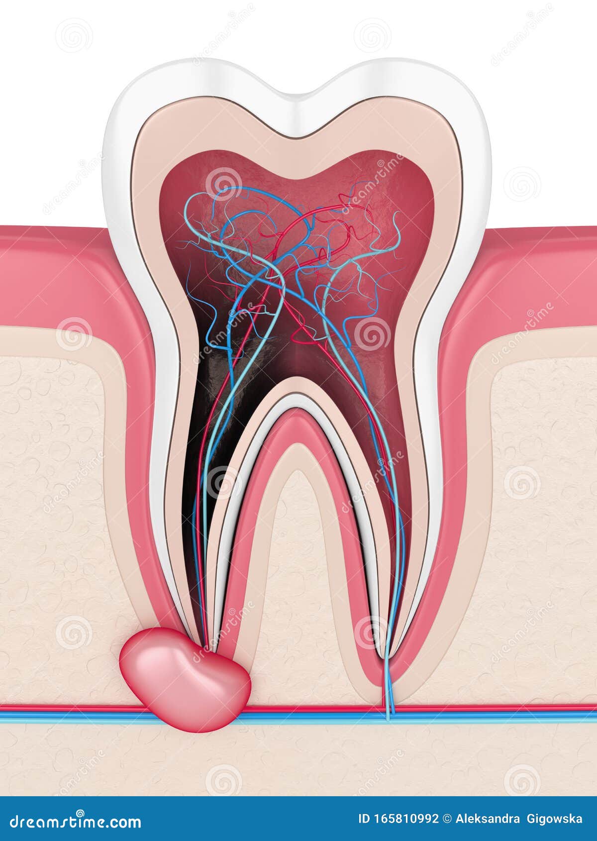 3d Render Of Jaw With Cyst On Teeth Root Stock Photo | CartoonDealer ...