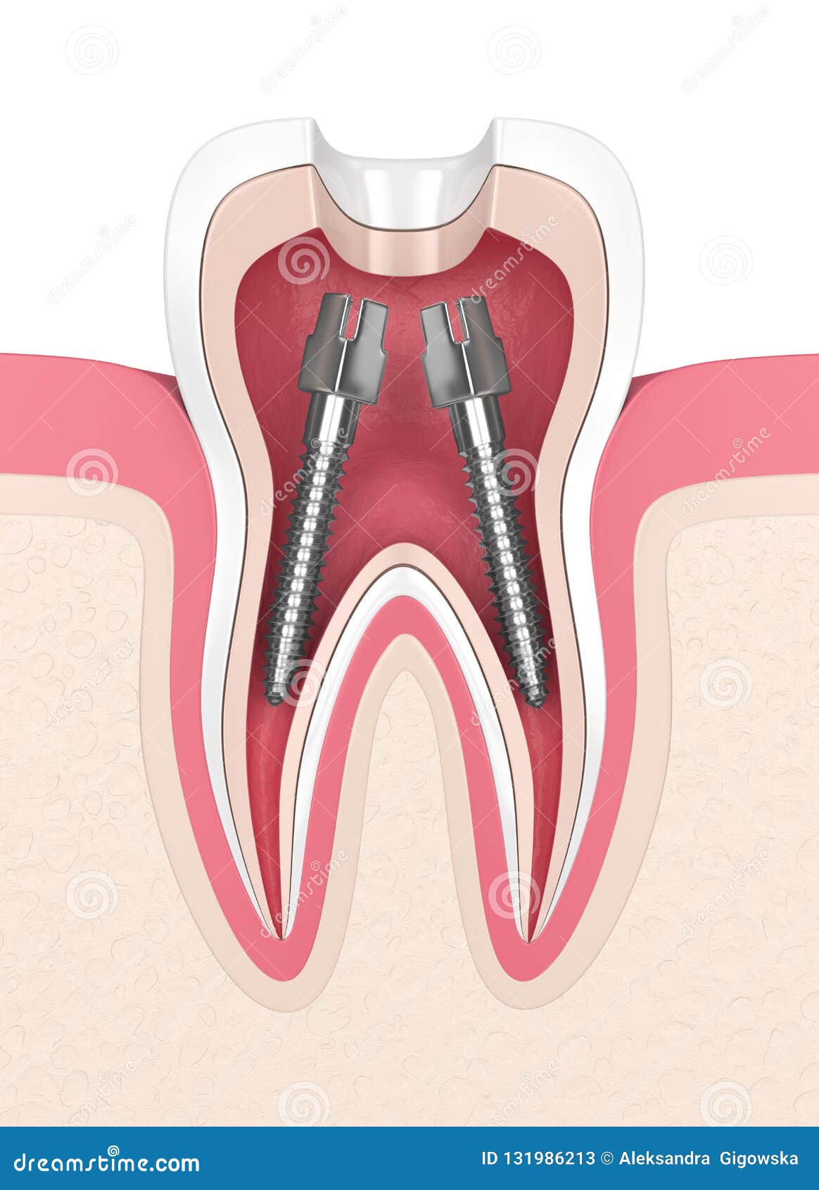 Dental Root Anatomy - First Maxillary Molar Tooth. Medically Accurate ...