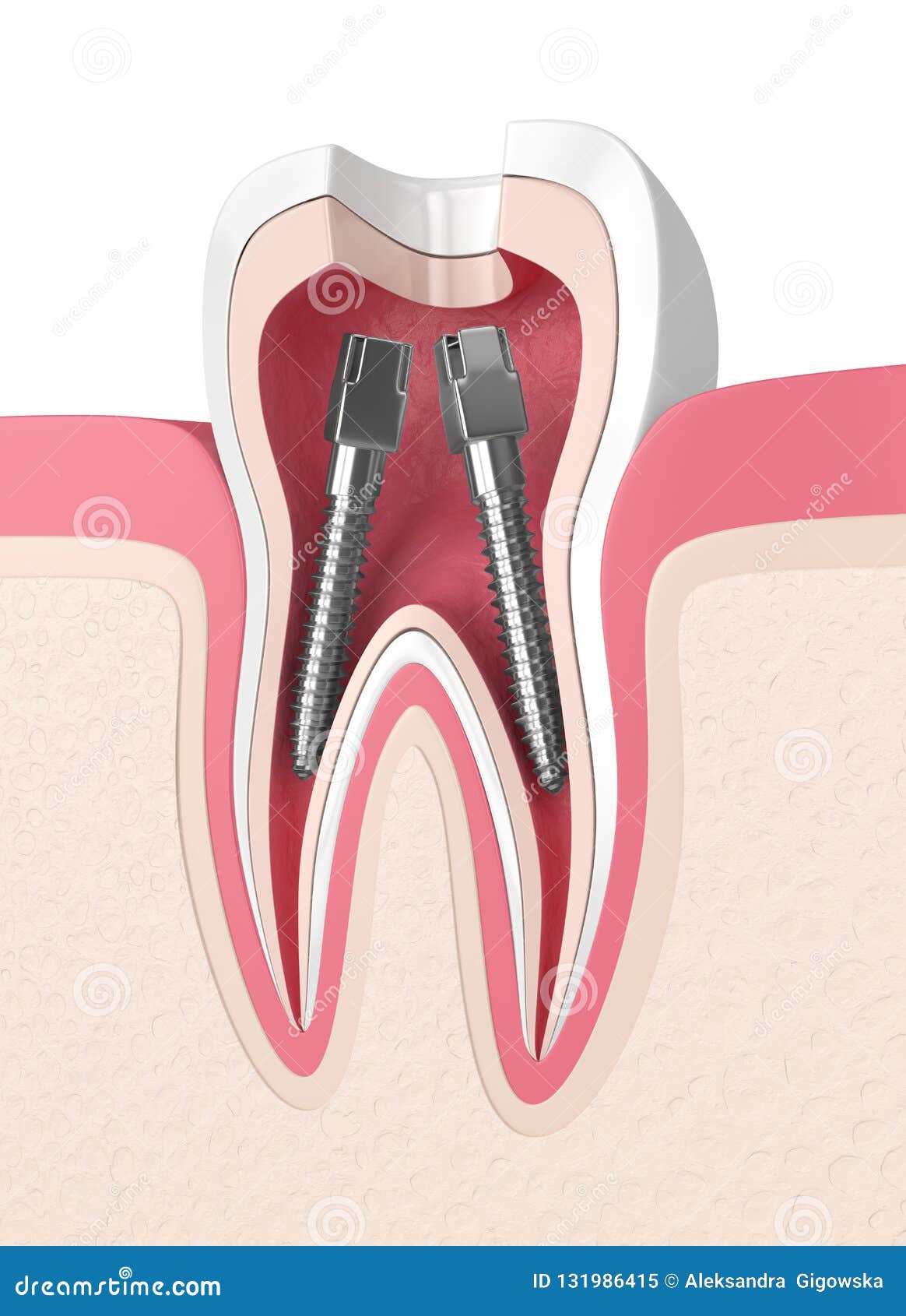 Dental Root Anatomy Of Mandibular Human Gum And Teeth, X-ray View ...