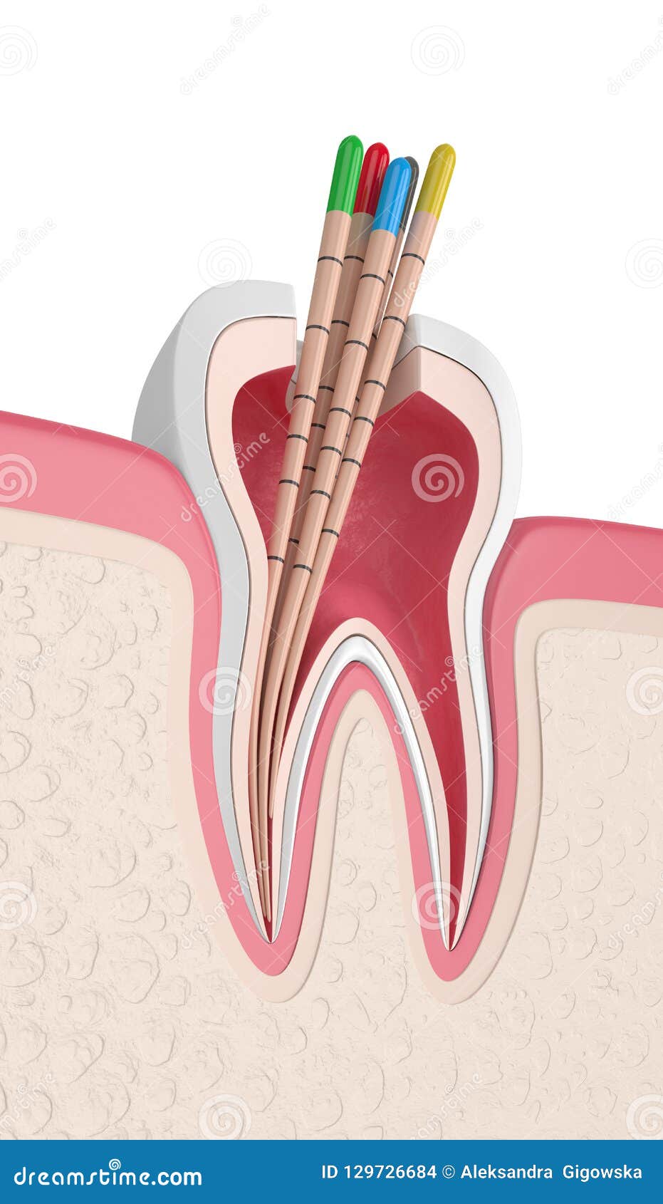 Gutta-percha Isonandra Gutta Or Palaquium Gutta Vintage Engraving ...