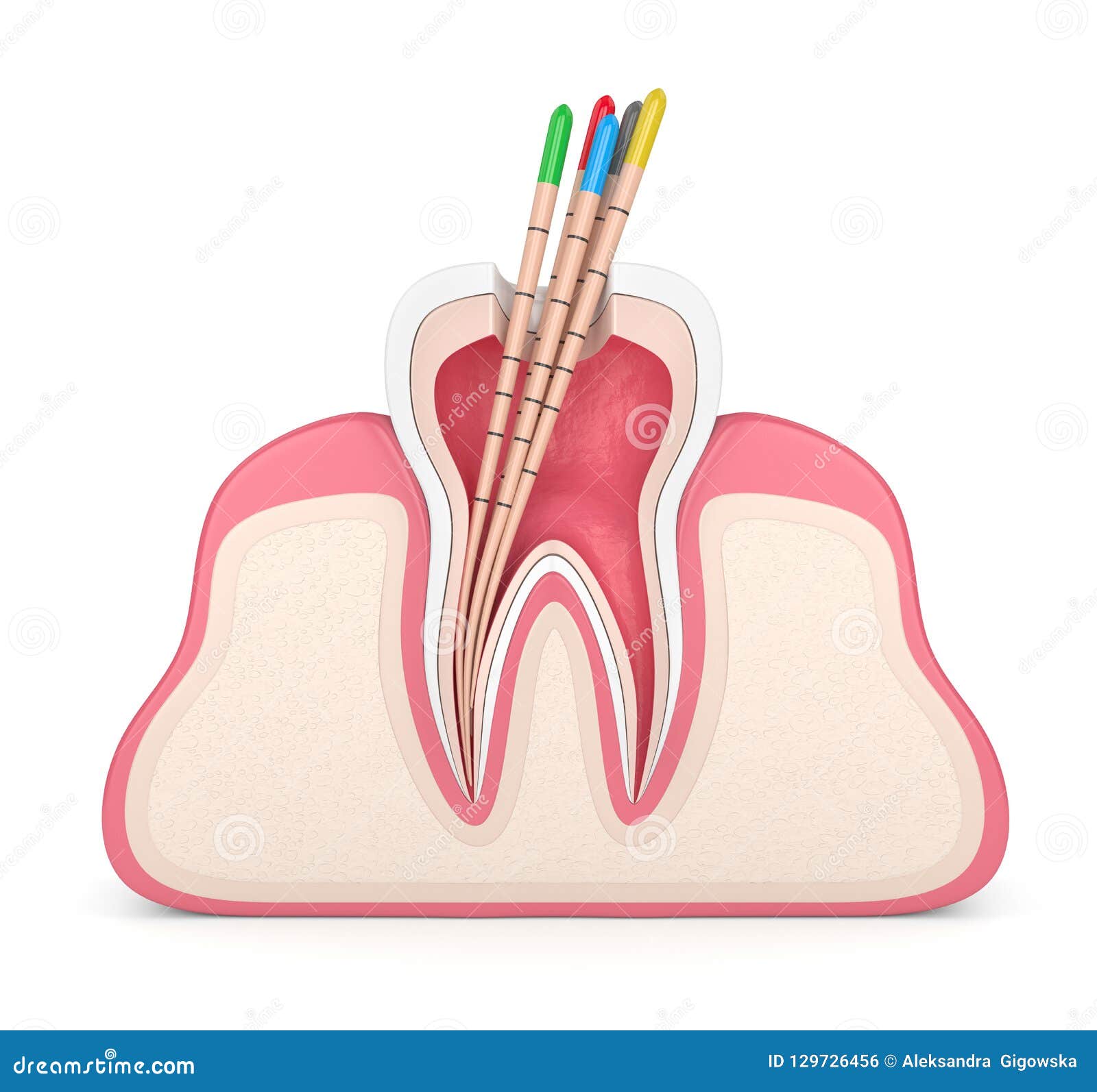 Gutta-percha Isonandra Gutta Or Palaquium Gutta Vintage Engraving ...