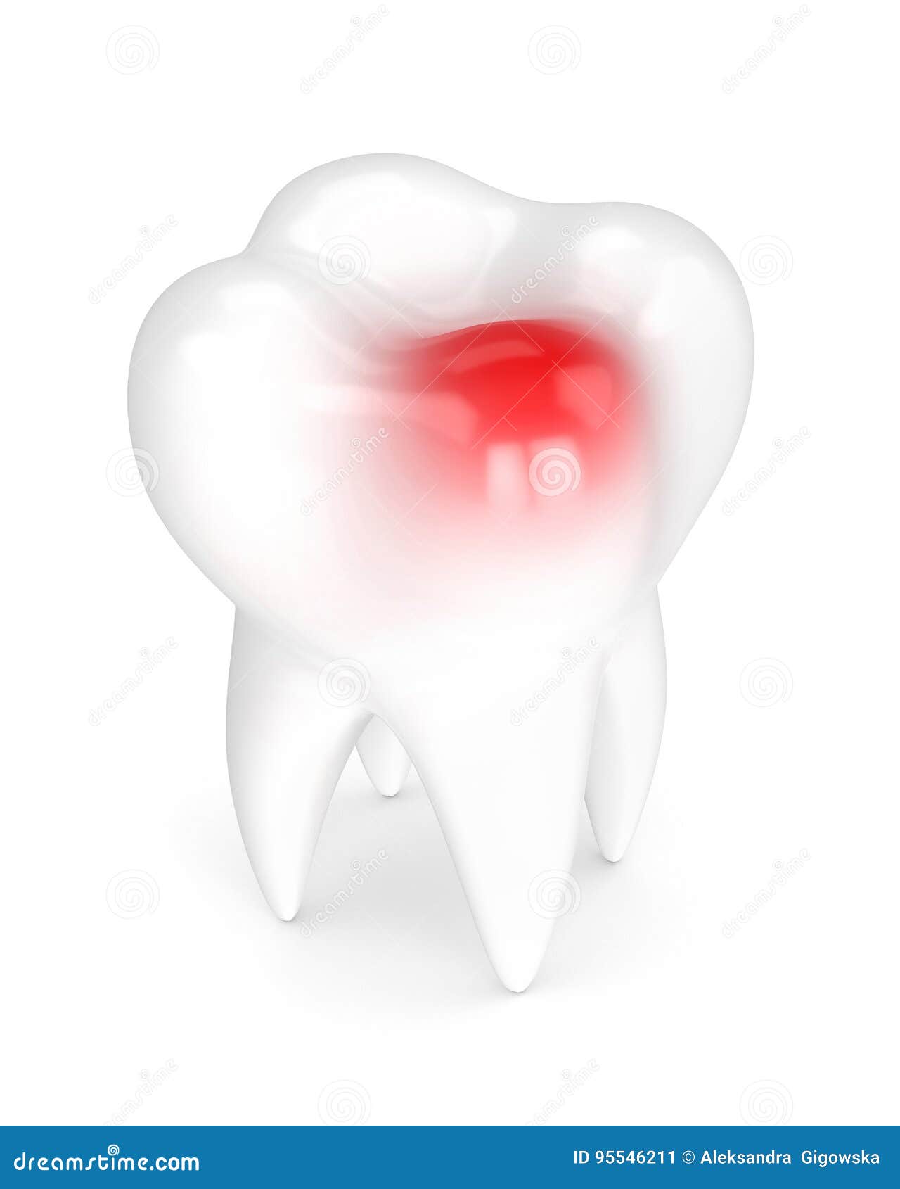 3d Render of Tooth with Toothache Over White Stock Illustration ...