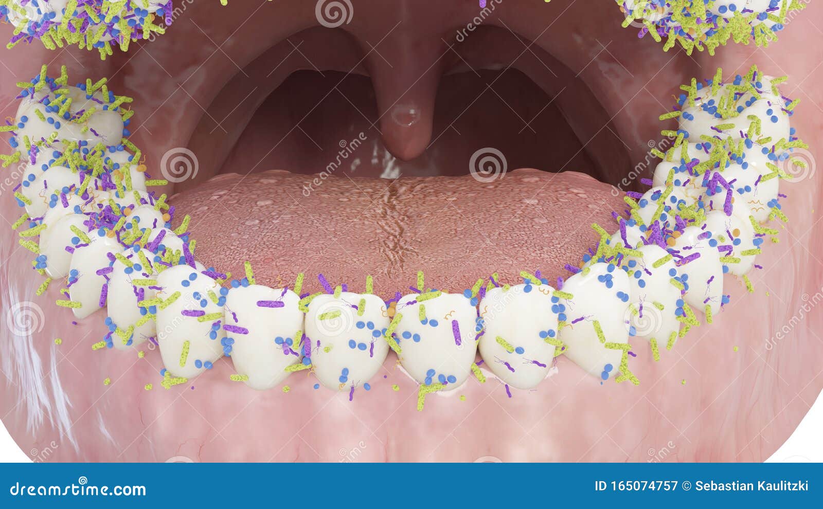 Bacteria on the teeth stock illustration. Illustration of mouth - 165074757