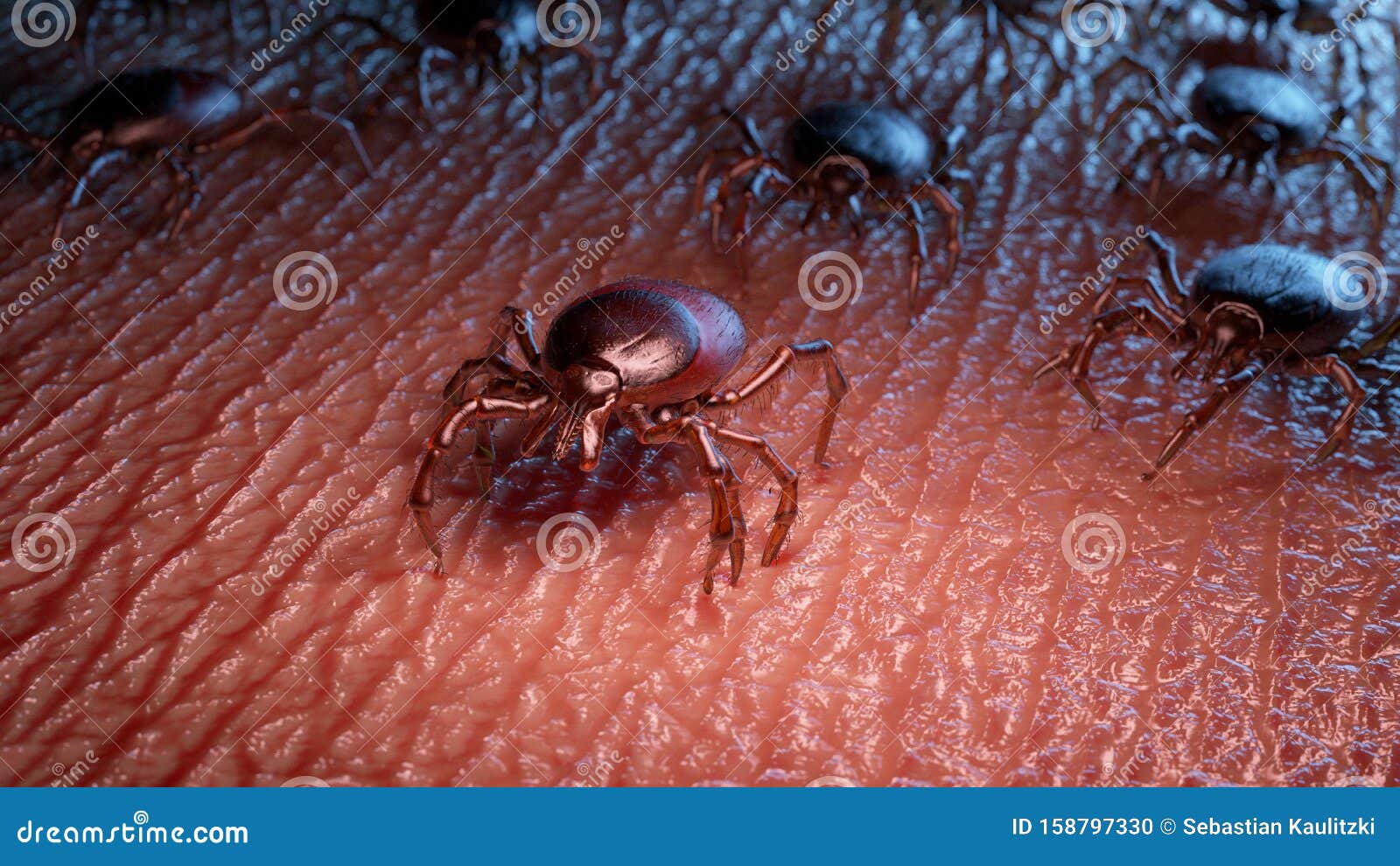 Ticks Crawling On Human Skin Stock Illustration | CartoonDealer.com ...