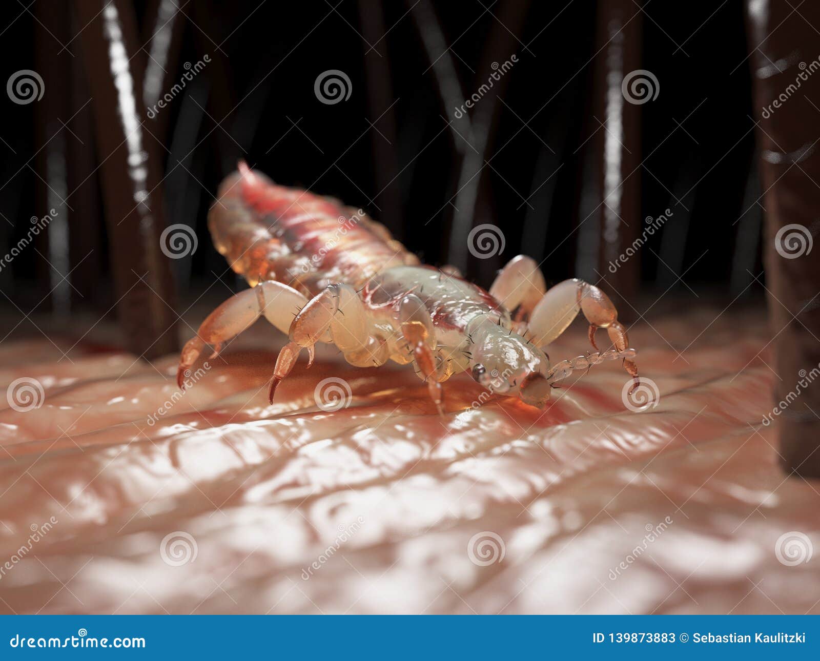 Head Louse Life Cycle Stock Photo | CartoonDealer.com #46581414