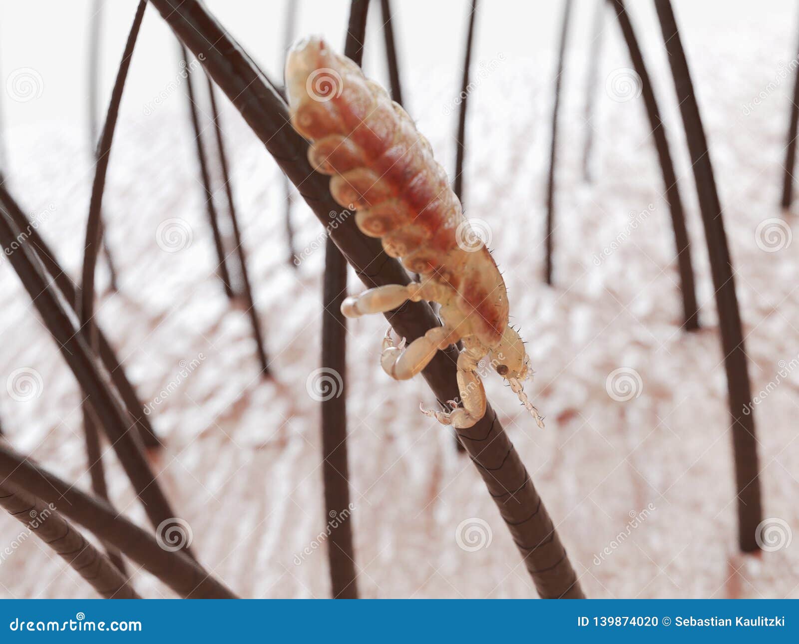 A head louse stock illustration. Illustration of graphic - 139874020