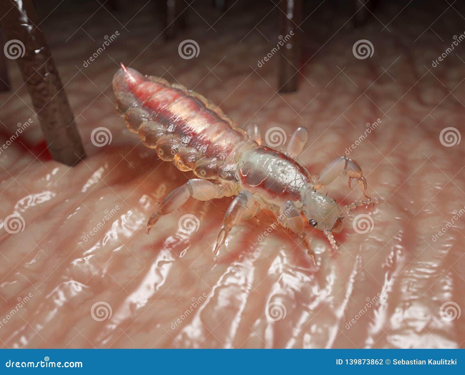 A head louse stock illustration. Illustration of circle - 139873862